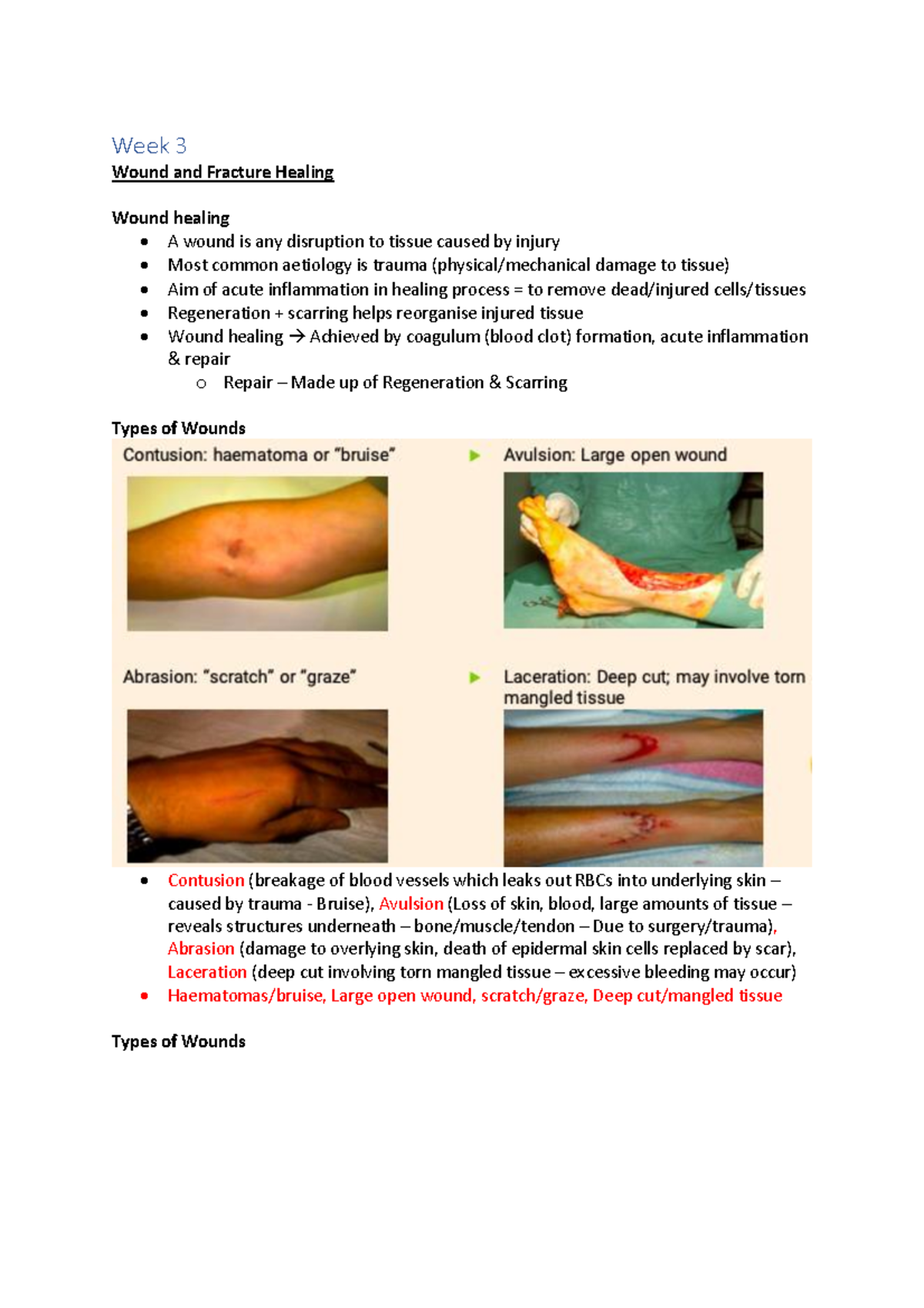 Week 3 - pathophysiology Week 3 notes full set - Week 3 Wound and ...