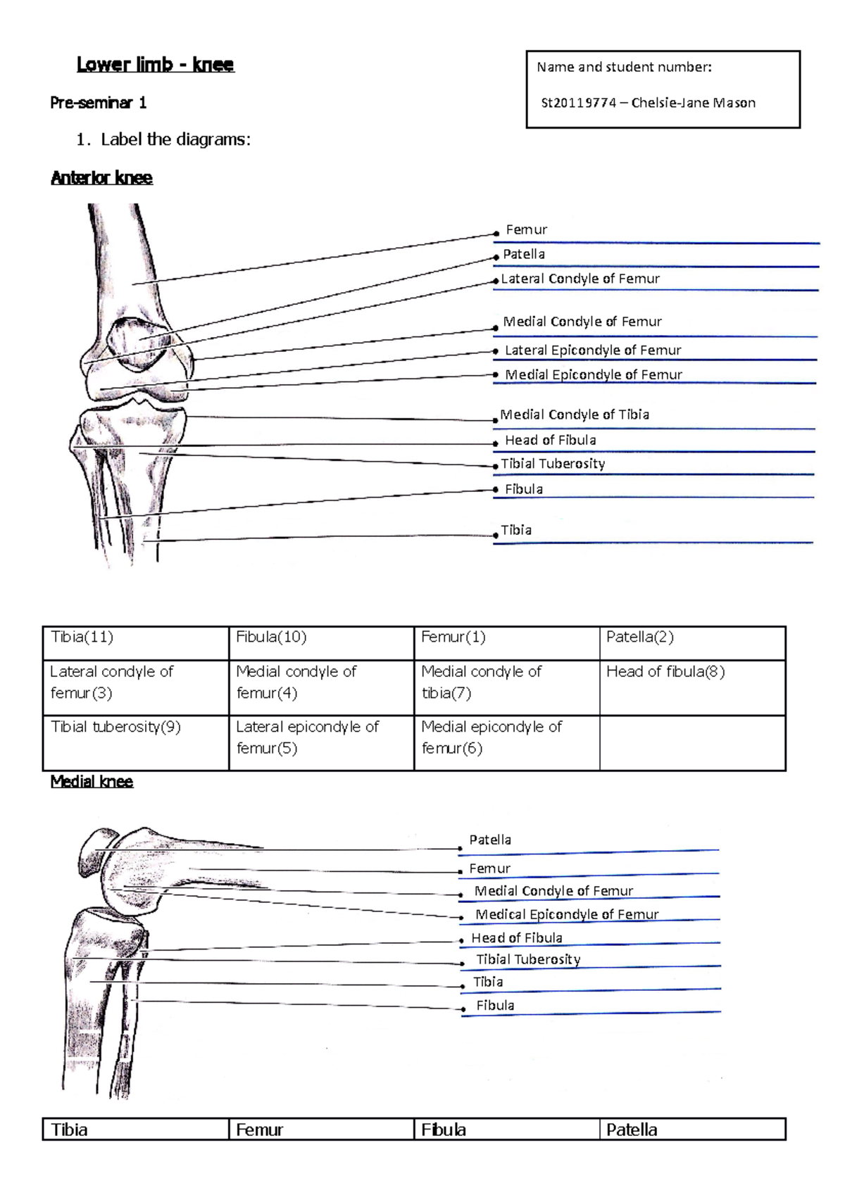 Knee 1 - Anatomy of the knee - Lower limb - knee Pre-seminar 1 1. Label ...
