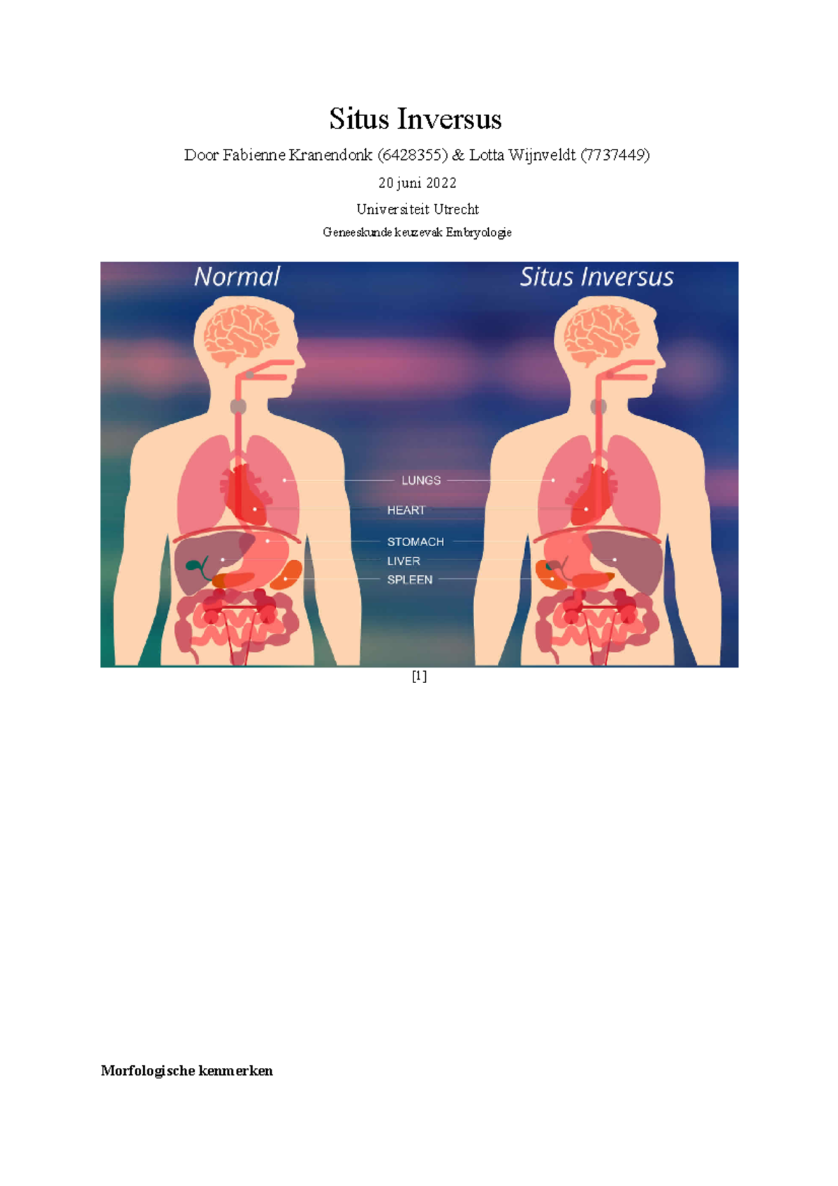 Verslag situs inversus - Situs Inversus Door Fabienne Kranendonk ...