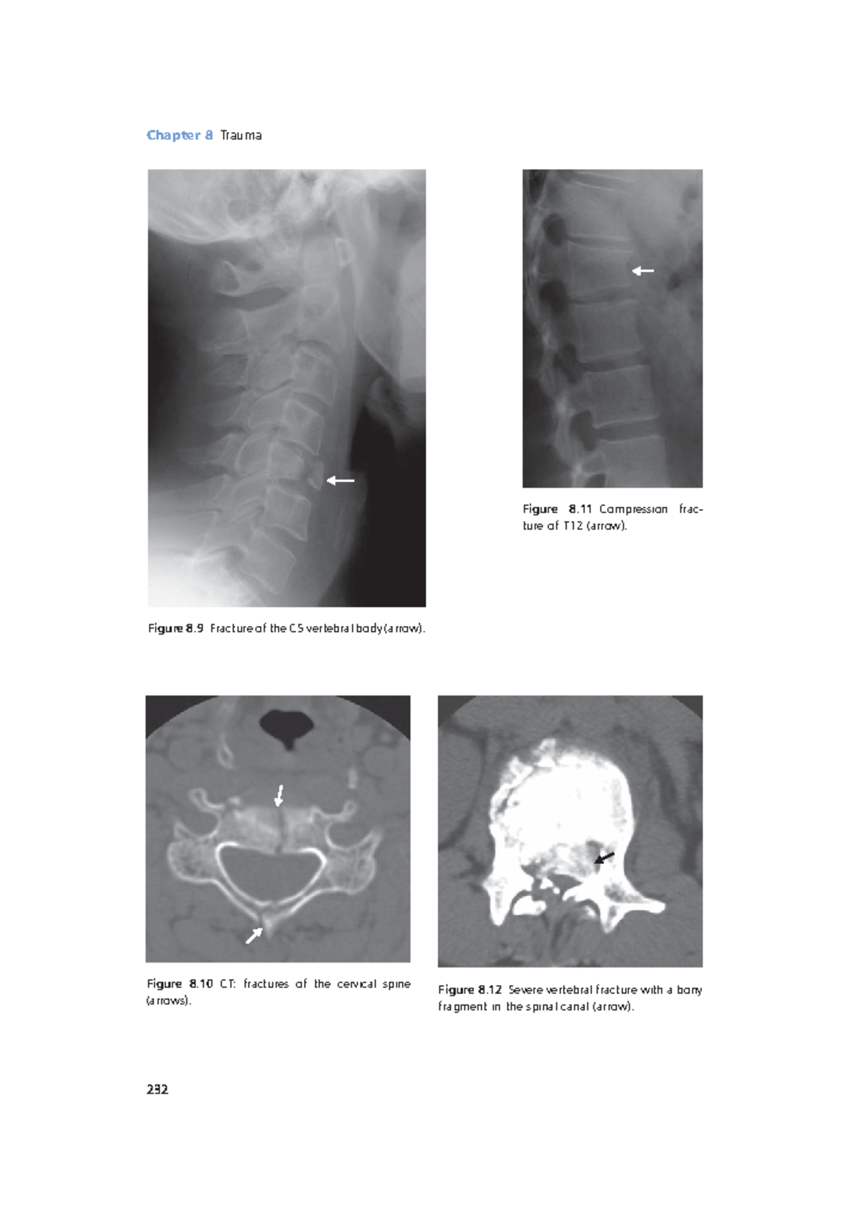 Radiology Lecture Notes pdf (78) - Chapter 8 Trauma 232 Figure 8 ...