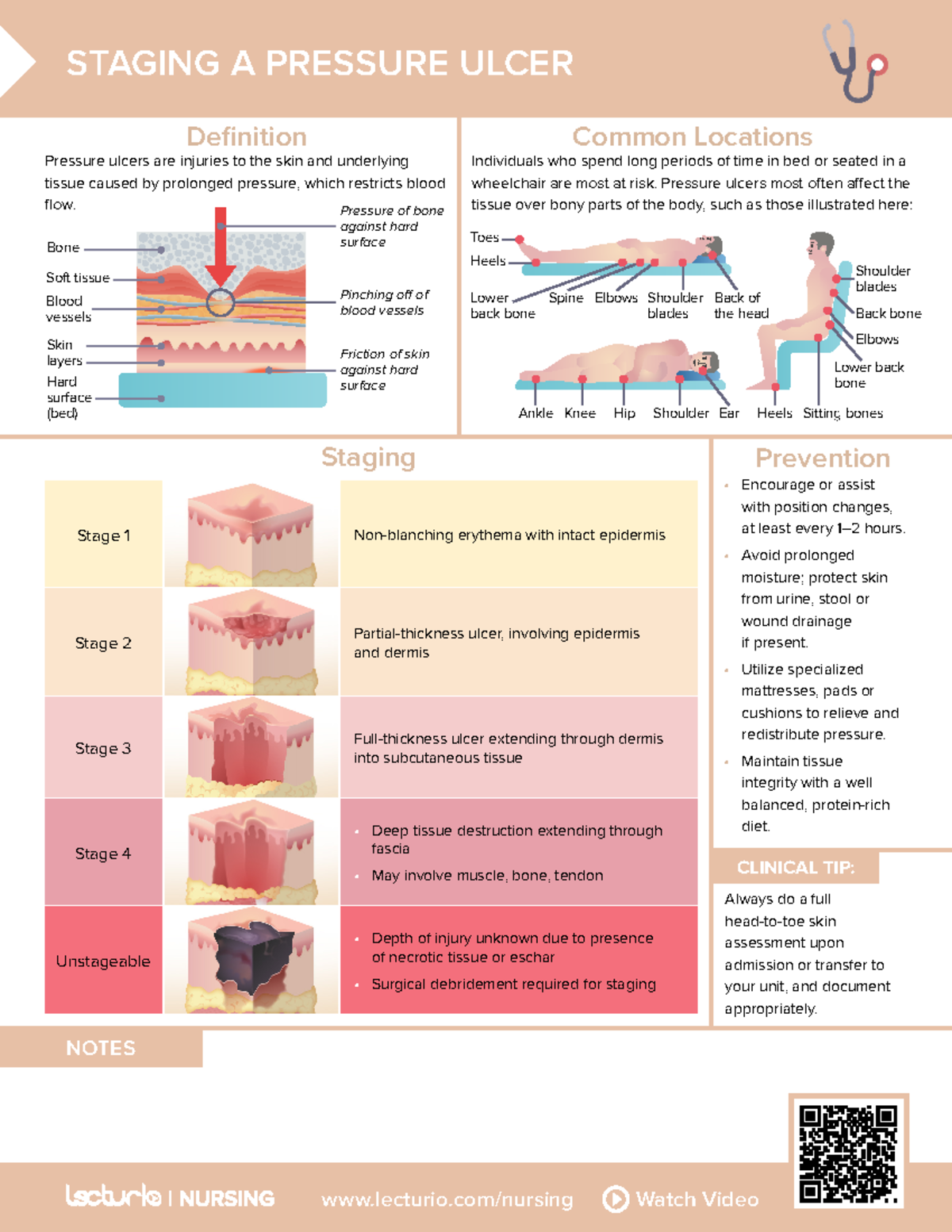 Nursing CS Staging-a-Pressure-Ulcer 02 - lecturio/nursing Watch Video ...
