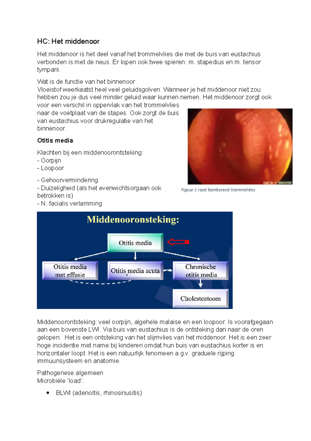 HC Middenooraandoeningen Keel, neus oor geneeskunde - HC: Het middenoor ...