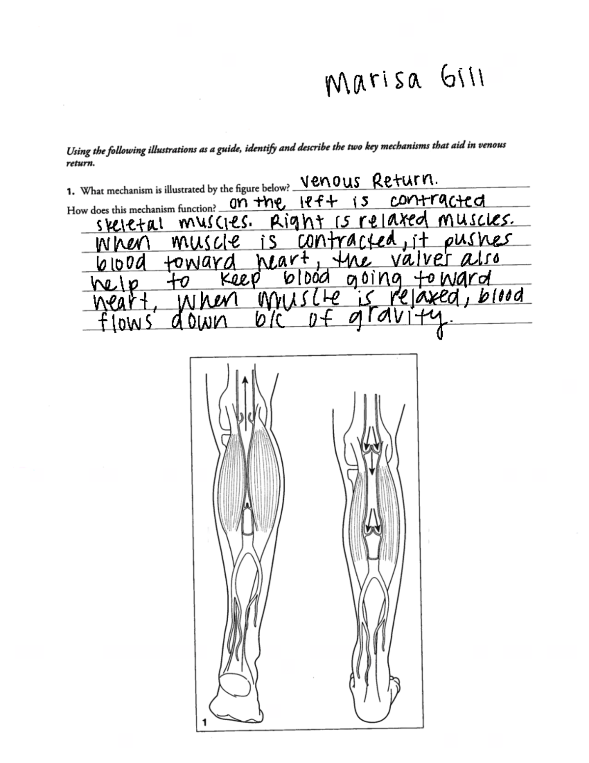 Vascular worksheet - Marisa Gill venous Return on the left is ...
