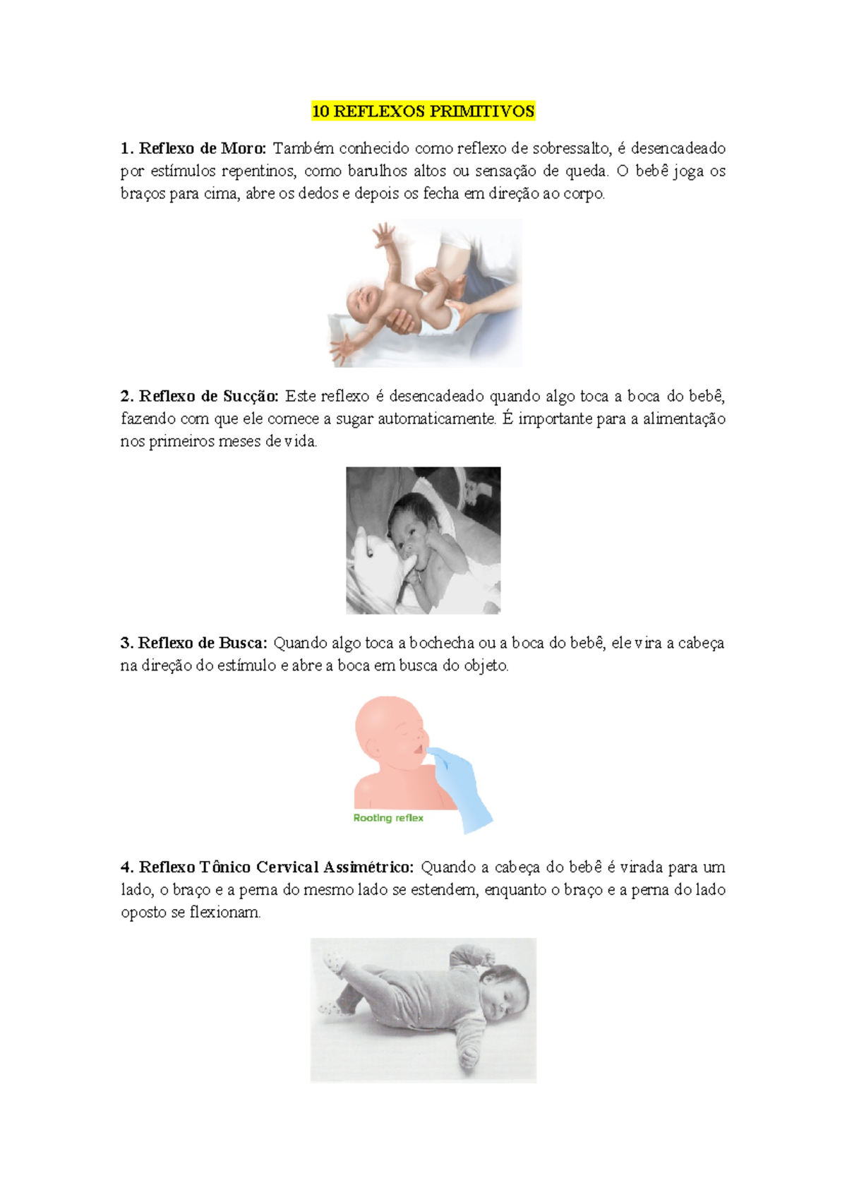 10 Reflexos Primitivos - 10 REFLEXOS PRIMITIVOS Reflexo de Moro: Também ...