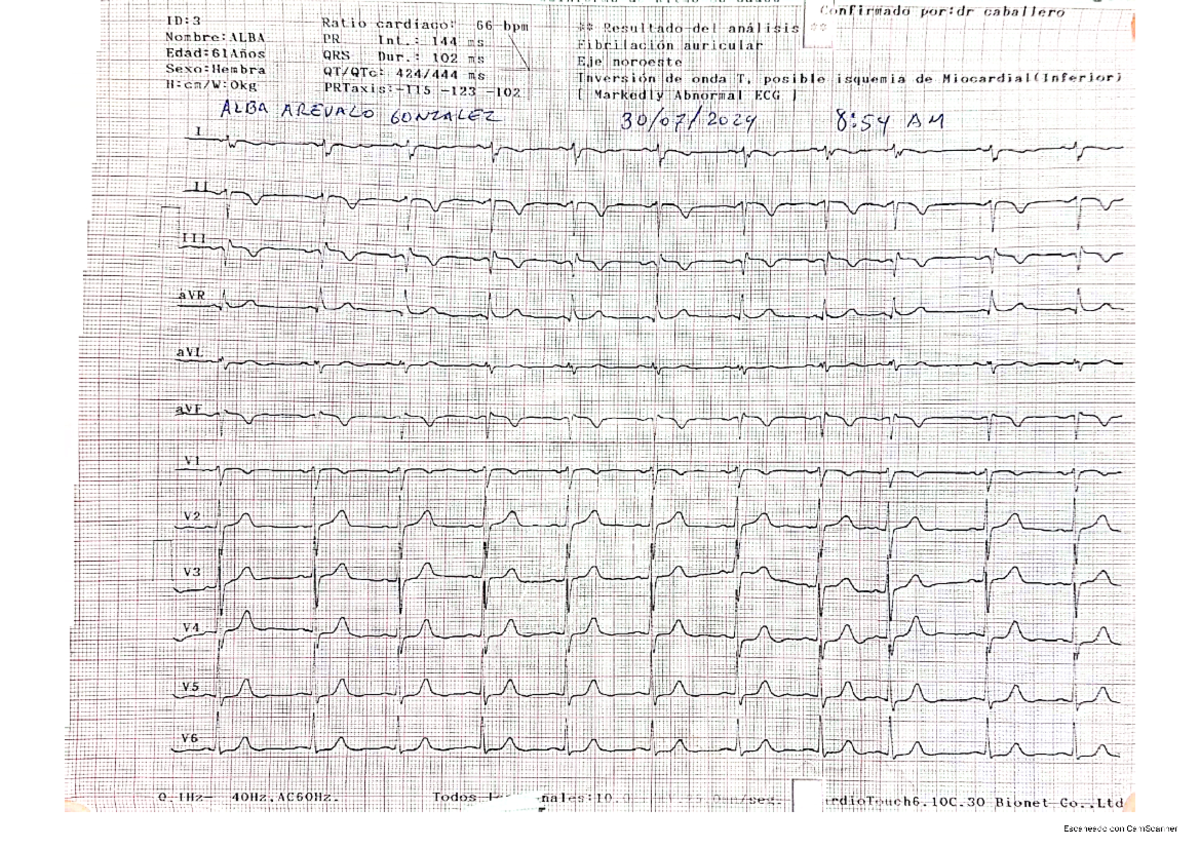 Electros 25 0ct - IMPORTANTE - Confirmado por:dr caballero ID:3 Ratio ...