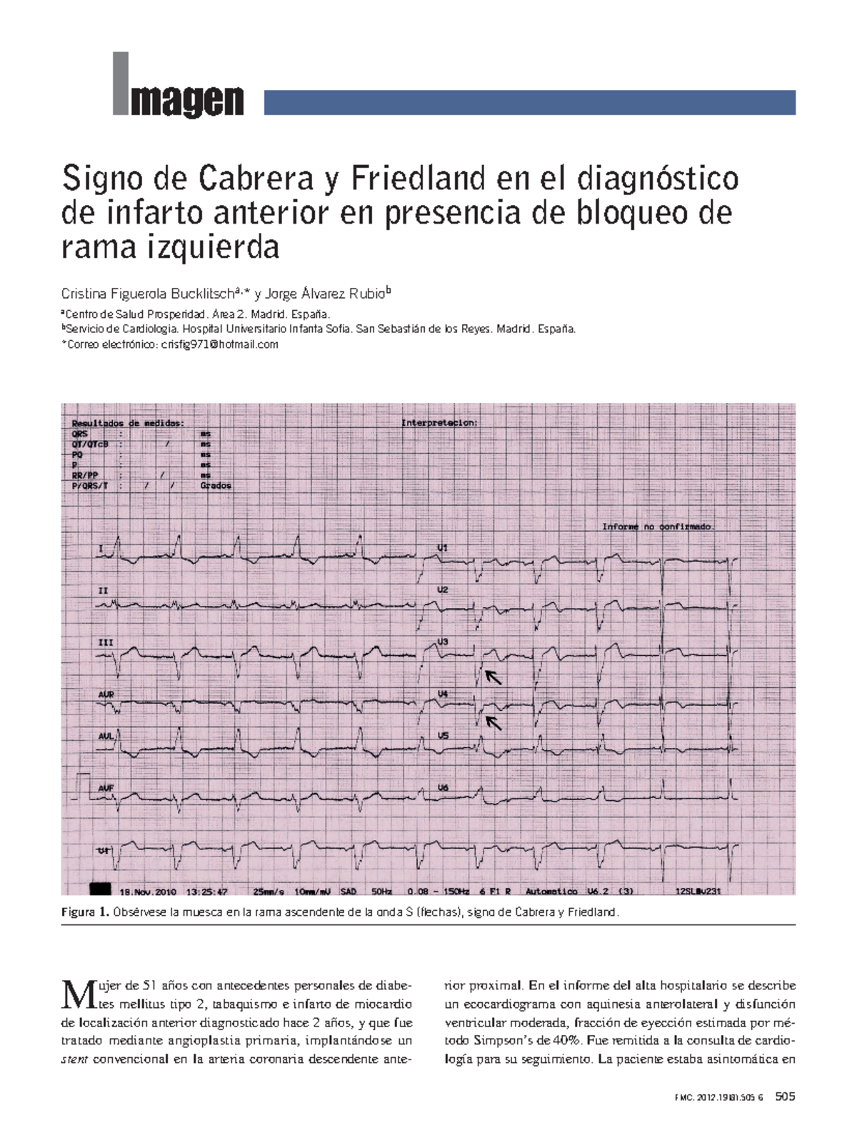 Signo de Cabrera - Imagen FMC. 2012;19(8):505-6 505 M ujer de 51 años ...