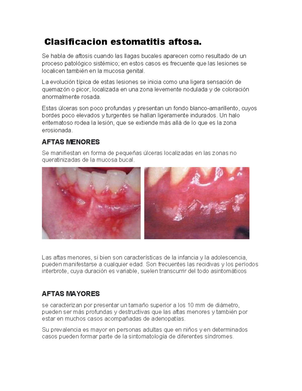 Clasificacion estomatitis aftosa - Se habla de aftosis cuando las ...