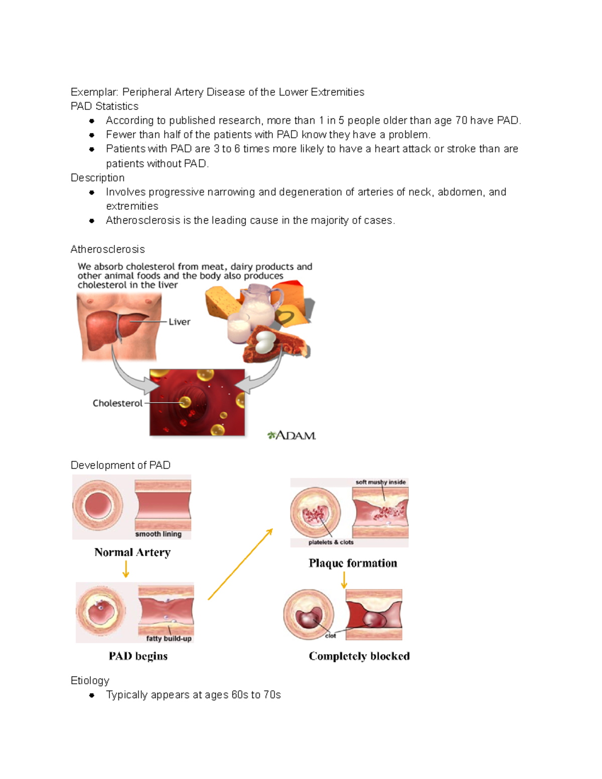 Exemplar Peripheral Artery Disease of the Lower Extremities - Fewer ...