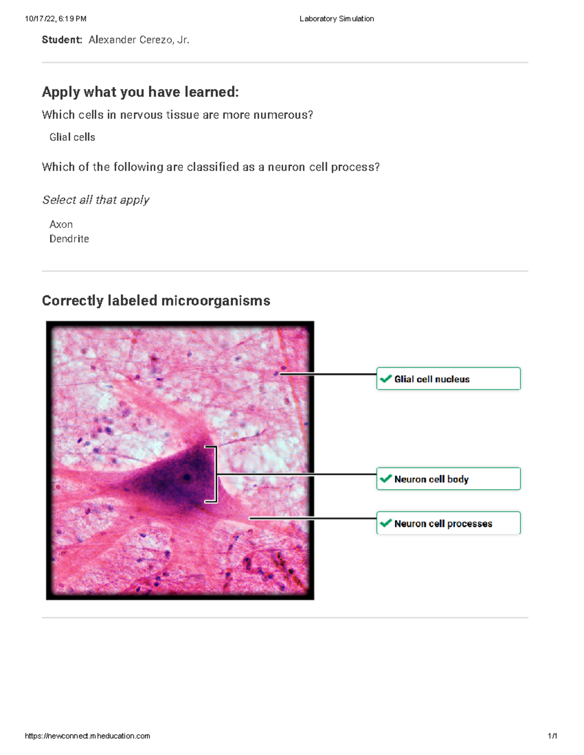 Microscopy - Nervous Tissue Histology - Biologie - 10/17/22, 6:19 PM ...
