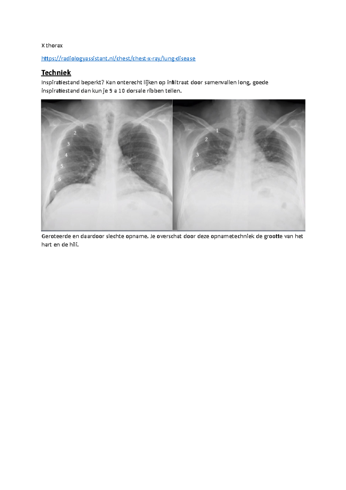 X thorax - plaatjes met uitleg en toelichting geordend per ziektebeeld ...