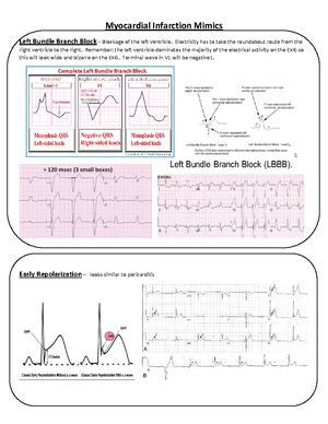 Chapter 12- 15 EMT - 12 lead EKG cheat sheet acls class paramedic paper ...
