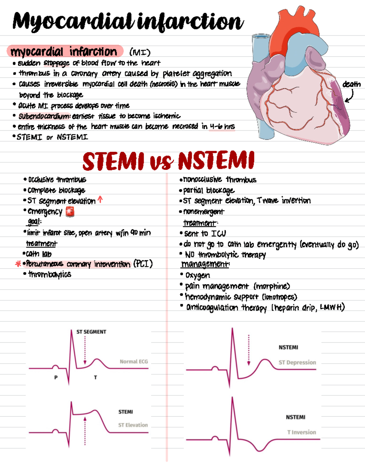 MI, Stemi, Nstemi - 2432 - Studocu