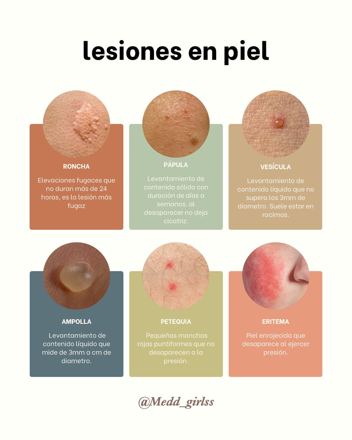 Lesiones en piel - Resumen Lecciones de dermatología - lesiones en piel Elevaciones fugaces que ...
