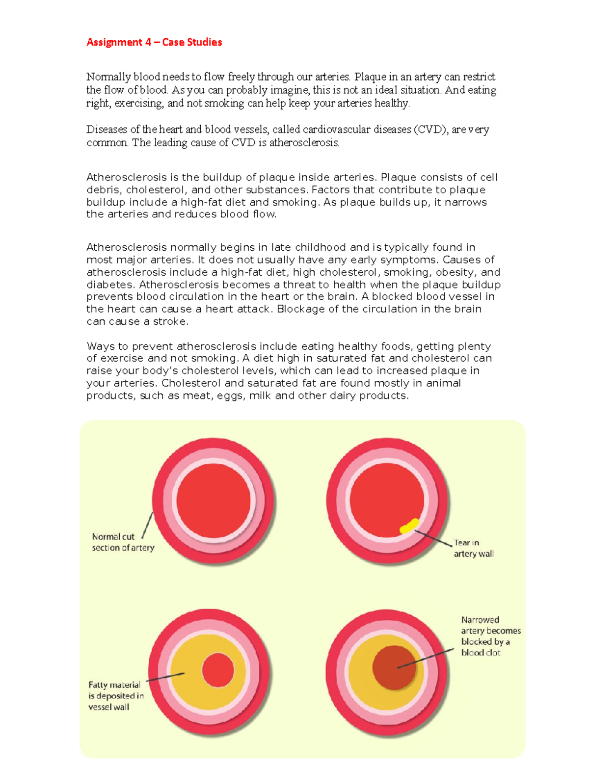 Assignment 4 - Cardiovascular Disease - Case Studies(1) - Assignment 4 ...