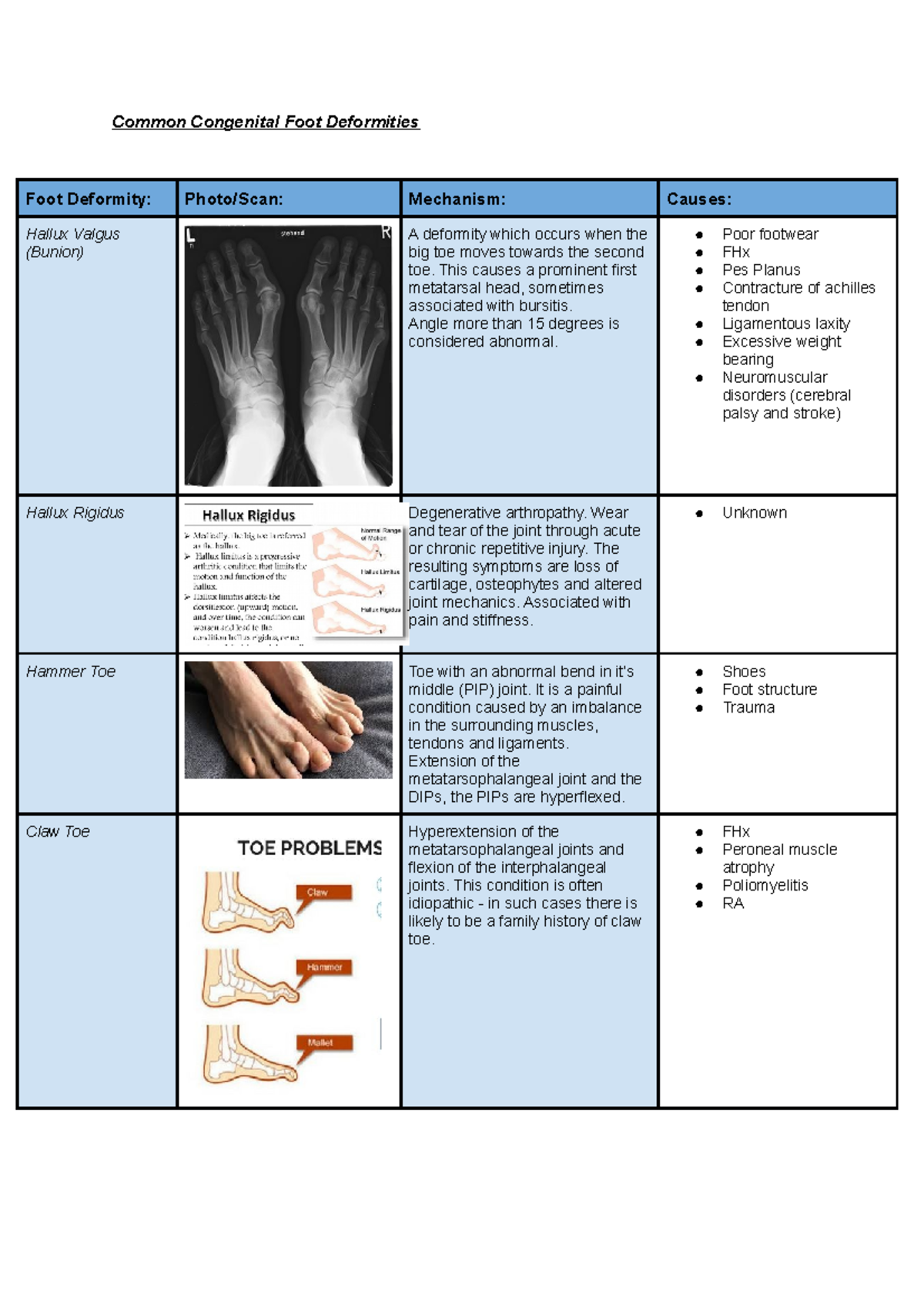 Congenital Foot Deformity - Common Congenital Foot Deformities Foot ...