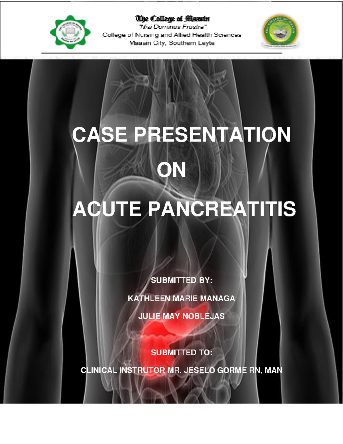 Acute Pancreatitis CASE Presentation