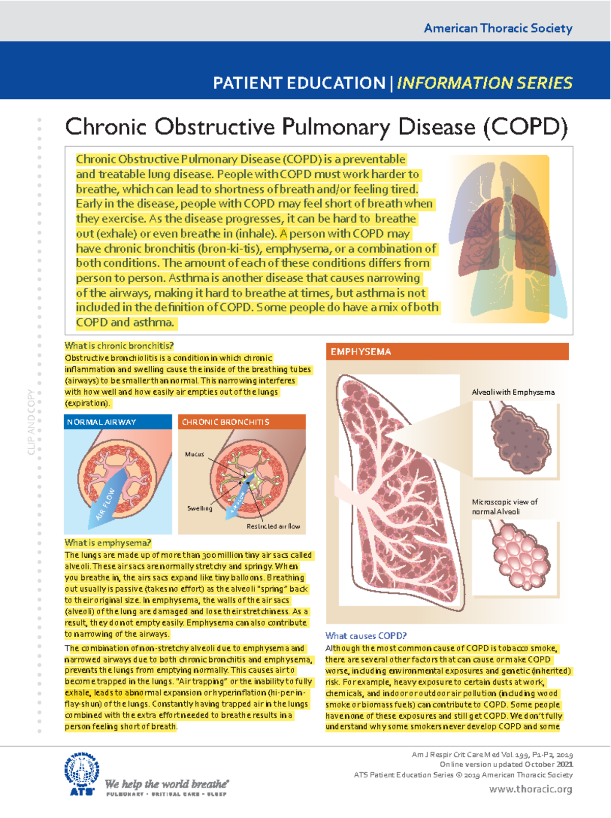 4 - Chronic obstructive pulmonary disease (COPD) is a chronic ...