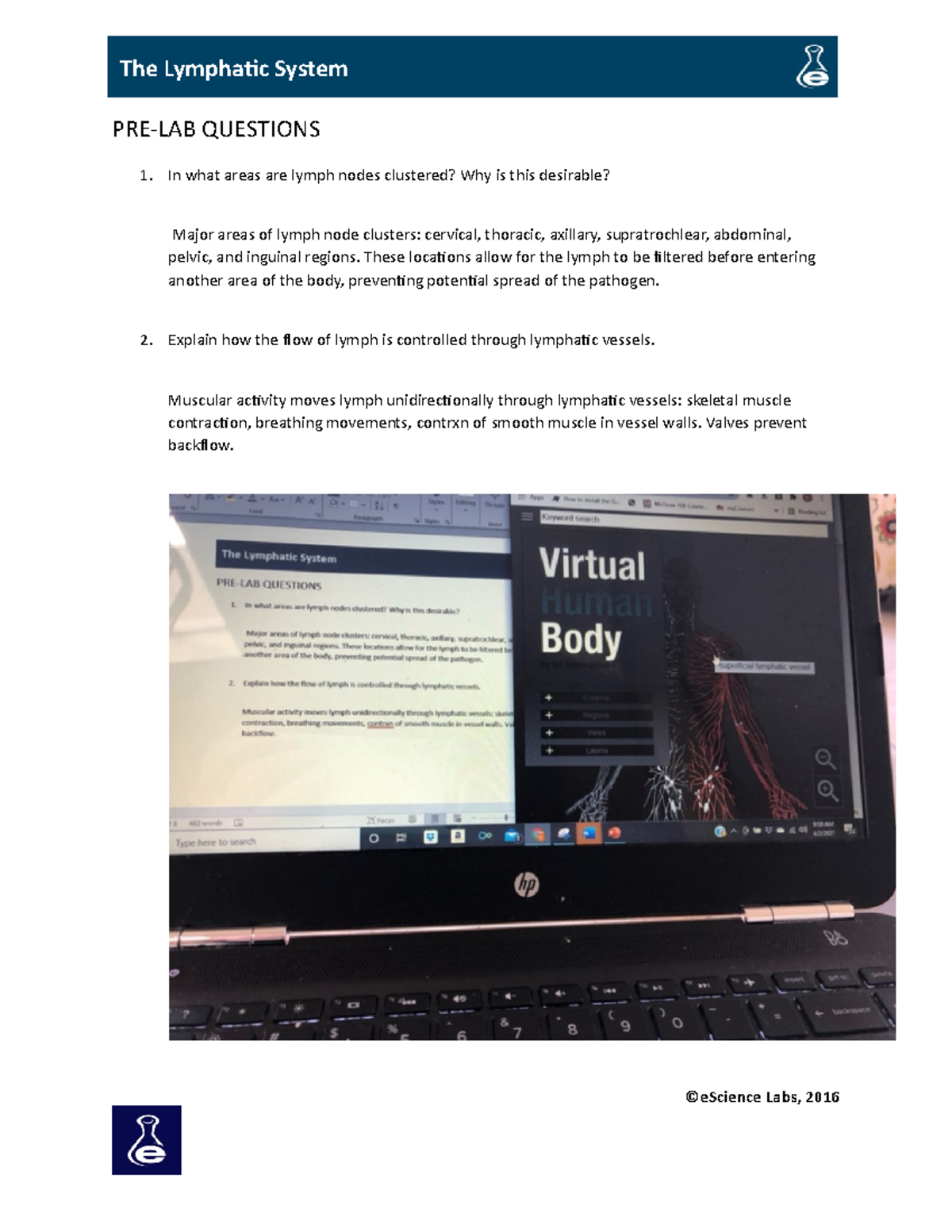 AP 5069 L12 Lymphatic - Virtual lab post-lab questions with answers and ...