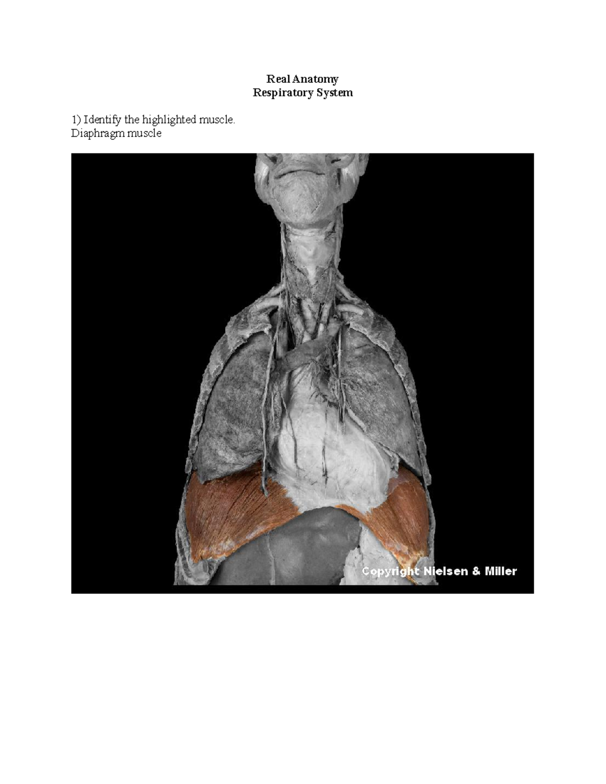 1 respiratory anatomy HW Bio 400 answer - Real Anatomy Respiratory ...