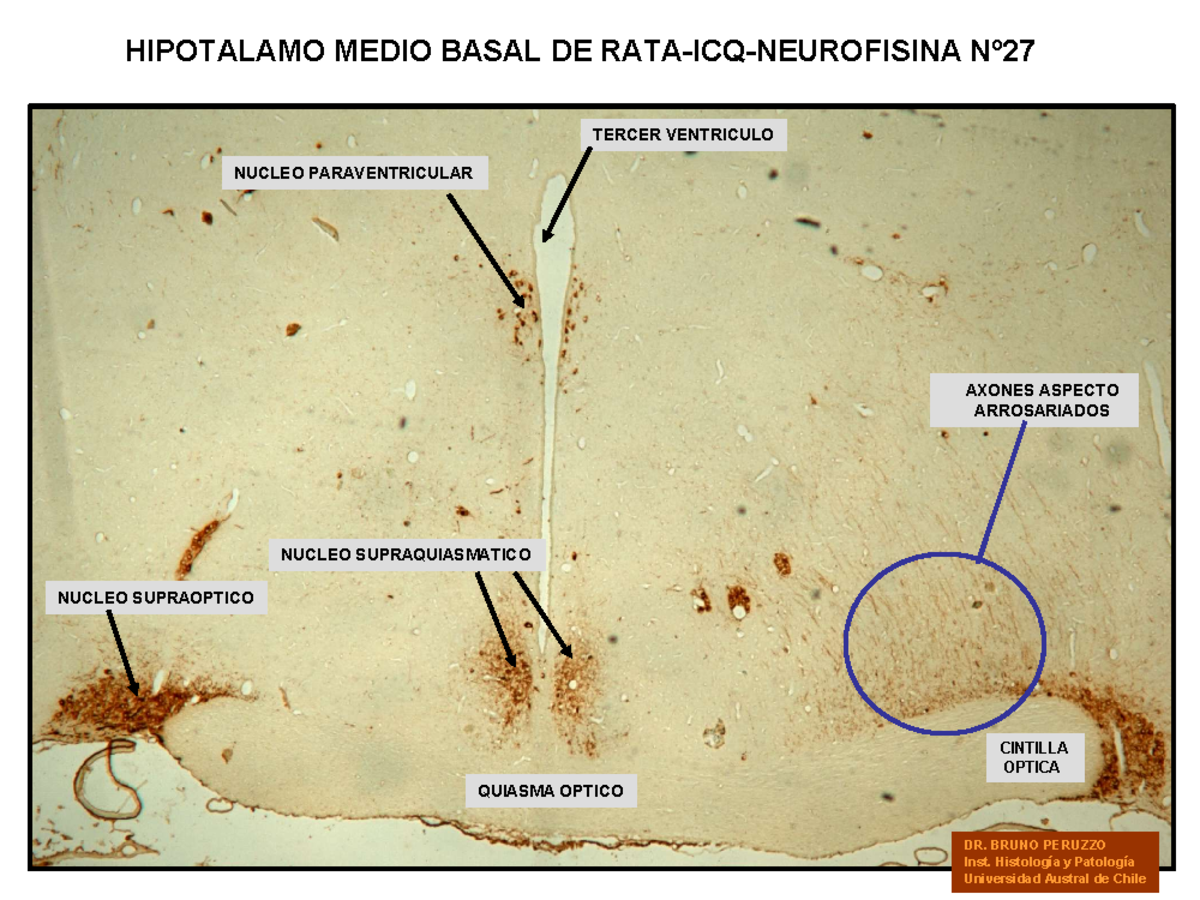 Práctico Hipotálamo Histologia Basica Uach Studocu