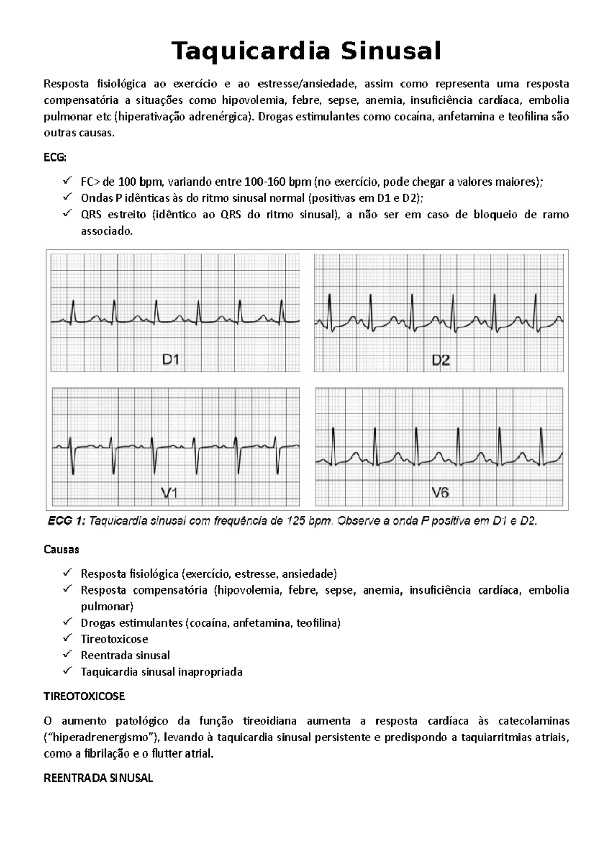 Taquicardia Sinusal - Taquicardia Sinusal Resposta fisiológica ao ...