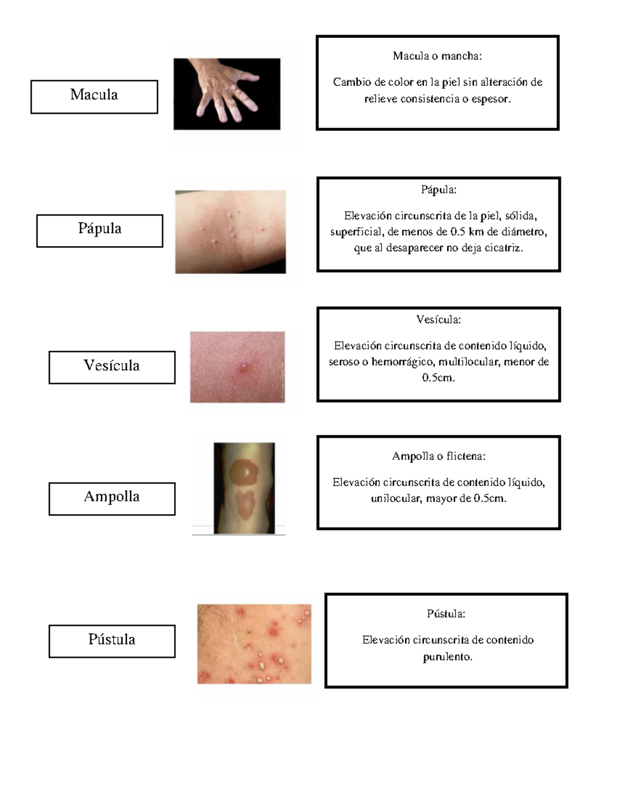Lab de Dermatología - Pápula Pápula: Elevación circunscrita de la piel ...