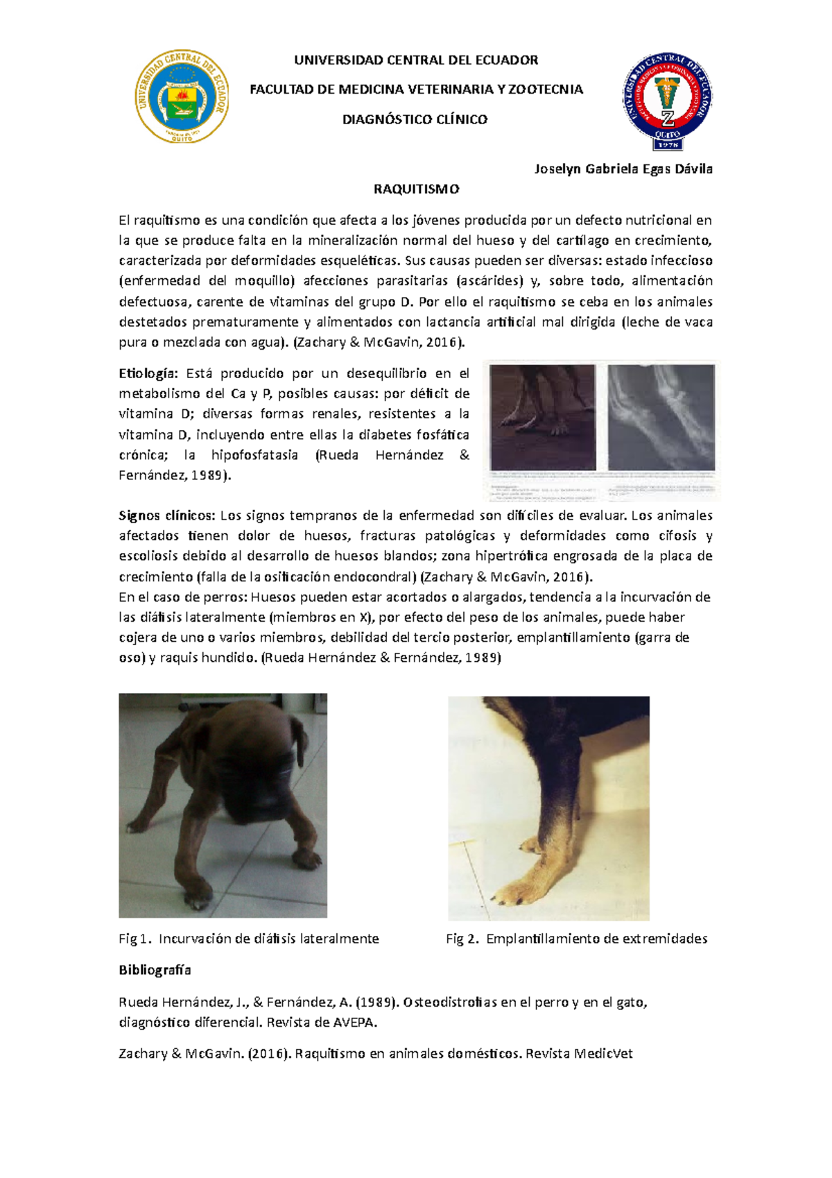 Raquitismo Patología - UNIVERSIDAD CENTRAL DEL ECUADOR FACULTAD DE ...