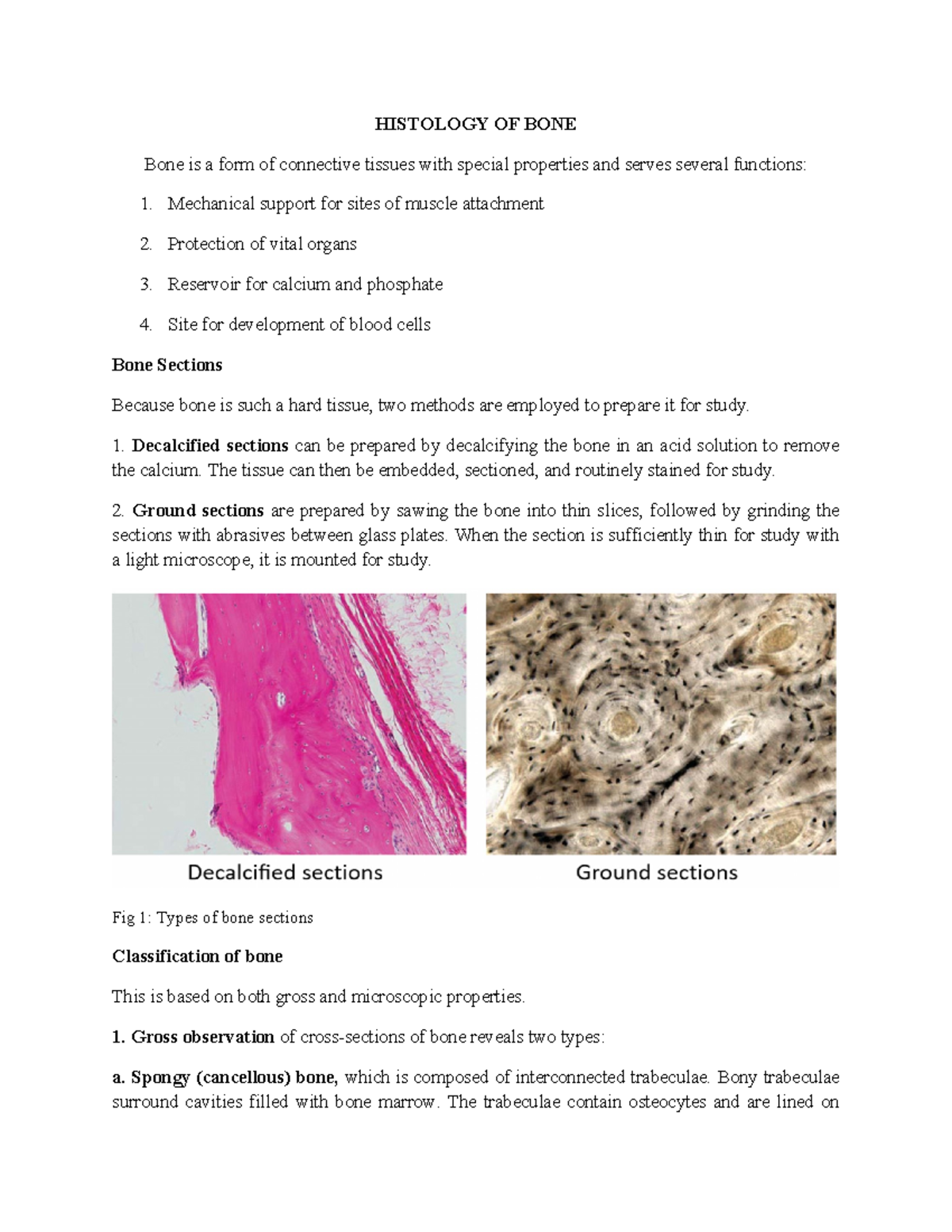 Histology OF BONE - HISTOLOGY OF BONE Bone is a form of connective ...