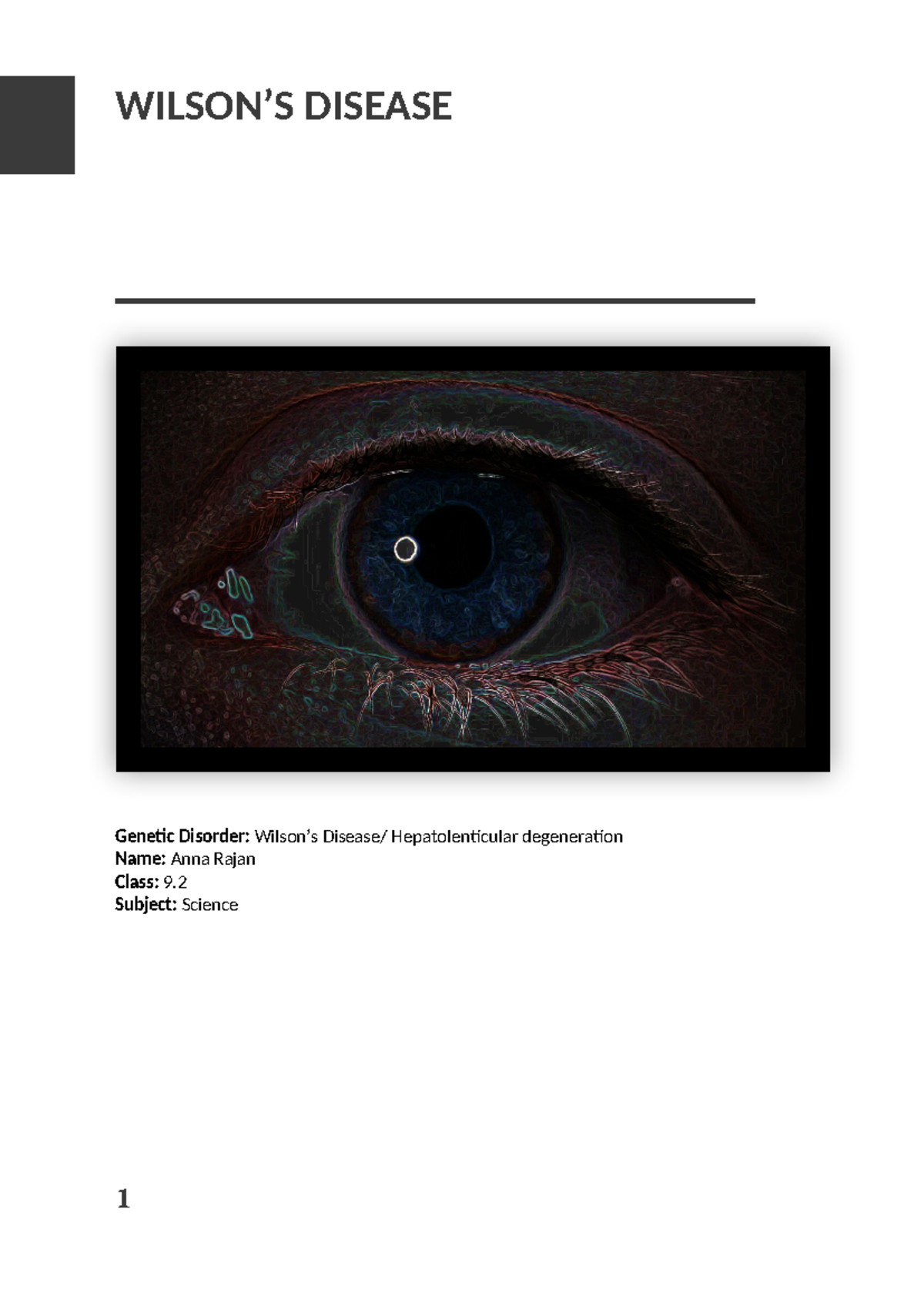 Wilson disease final copy - WILSON’S DISEASE Genetic Disorder: Wilson’s ...