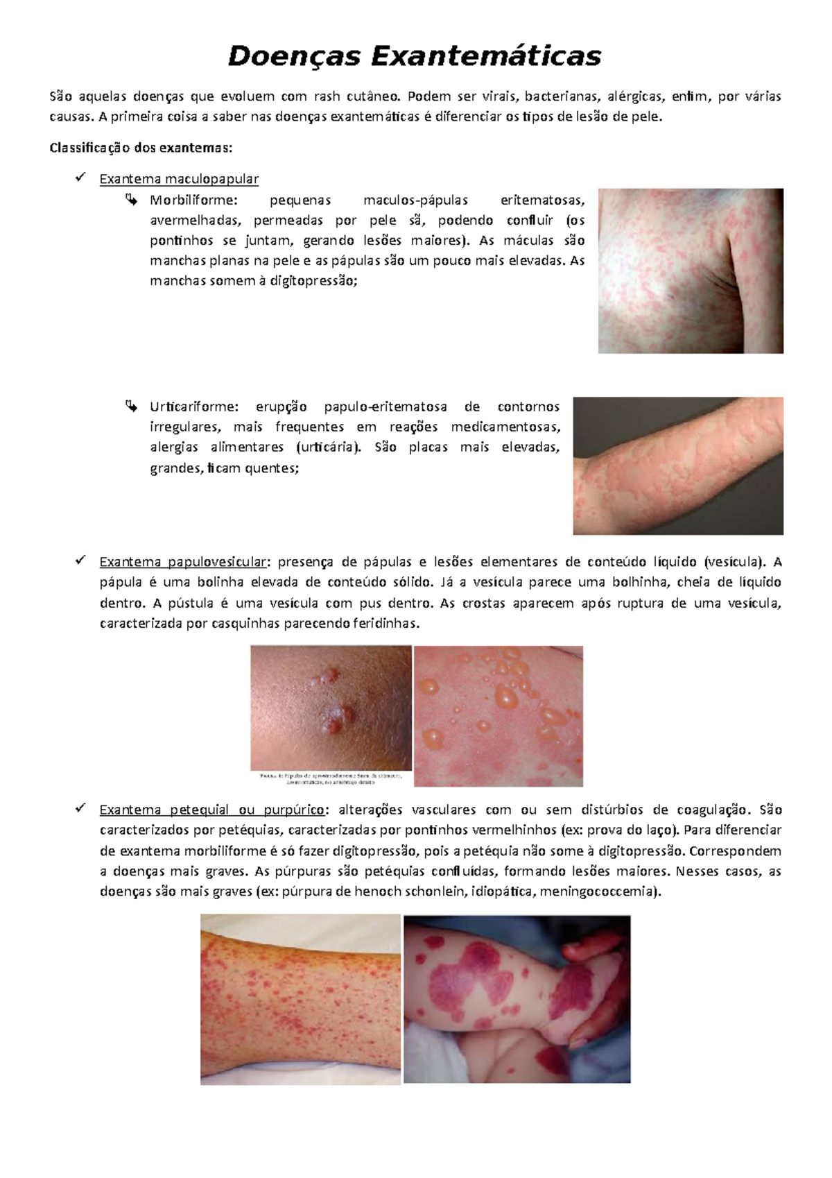 Doenças Exantemáticas - Doenças Exantemáticas São aquelas doenças que ...