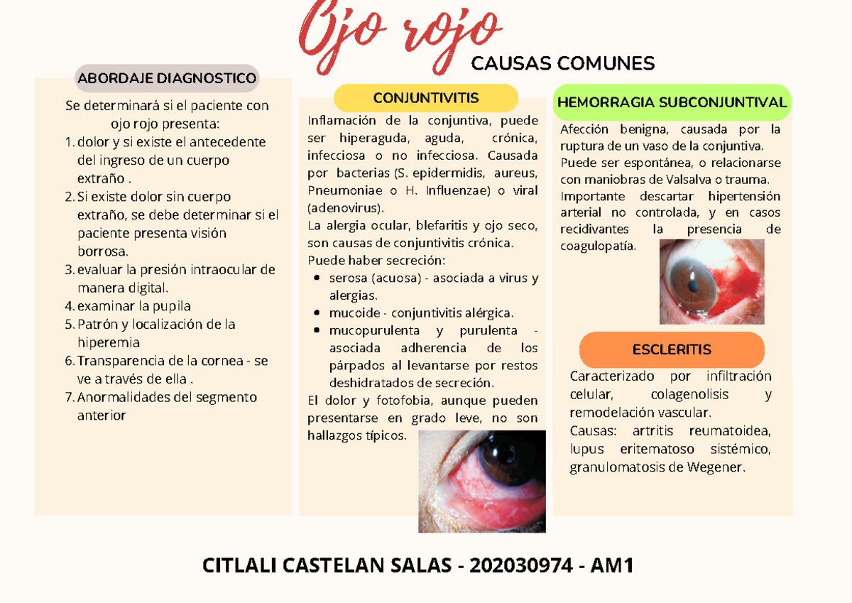 Ojo rojo - ABORDAJE DIAGNOSTICO CONJUNTIVITIS HEMORRAGIA SUBCONJUNTIVAL ...