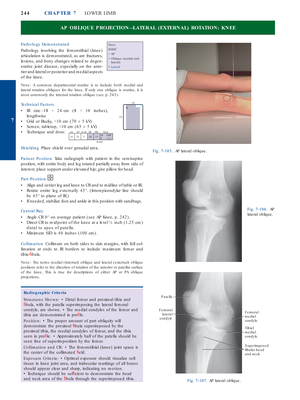 XRAY PROJECTION AP PROJECTION: ANKLE - LO W E R LI M B CHAP TER 7 235 7 ...