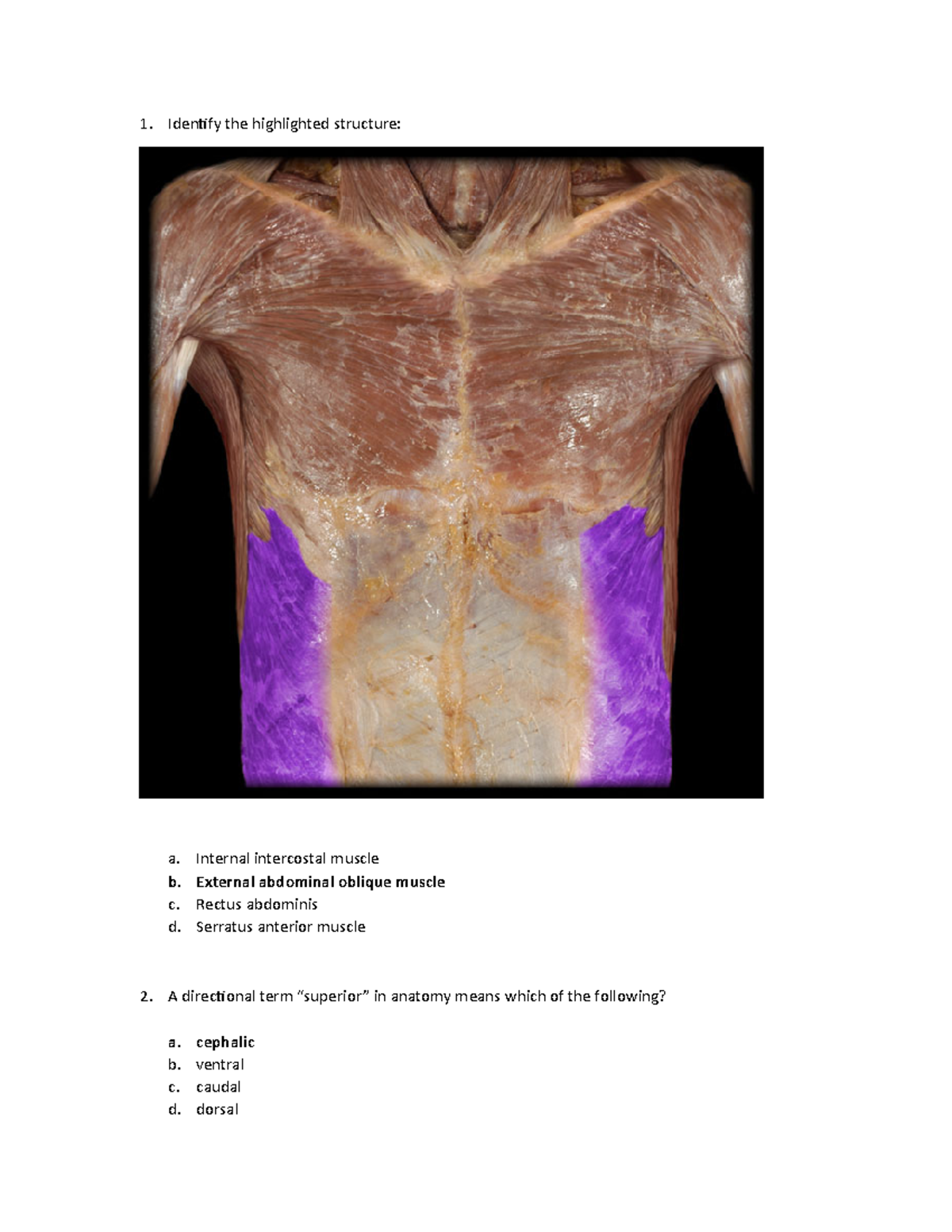 Prelim Gross Ana Lab Set A - Identify the highlighted structure: a ...
