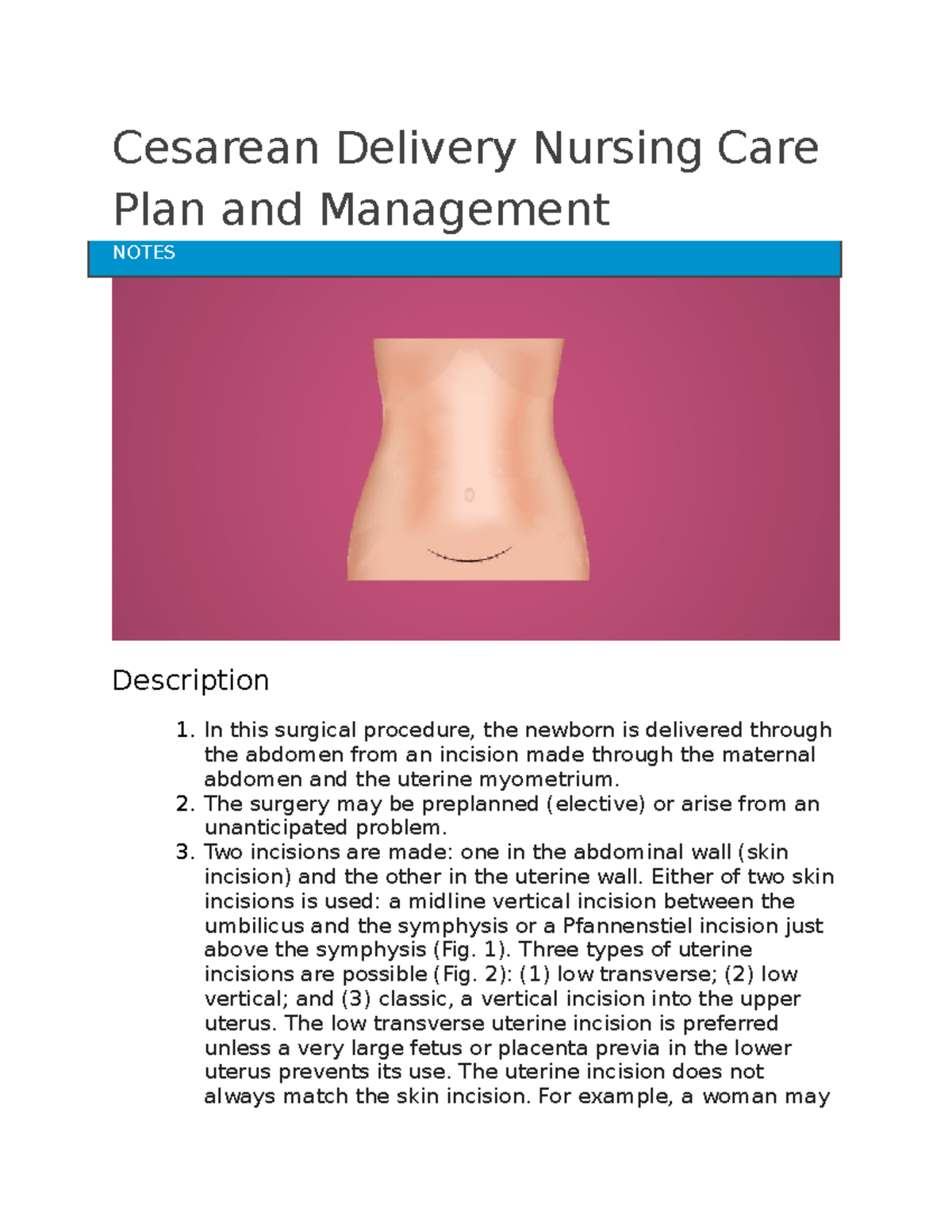 Cesarean Delivery Nursing Care Plan And Management Cesarean Delivery