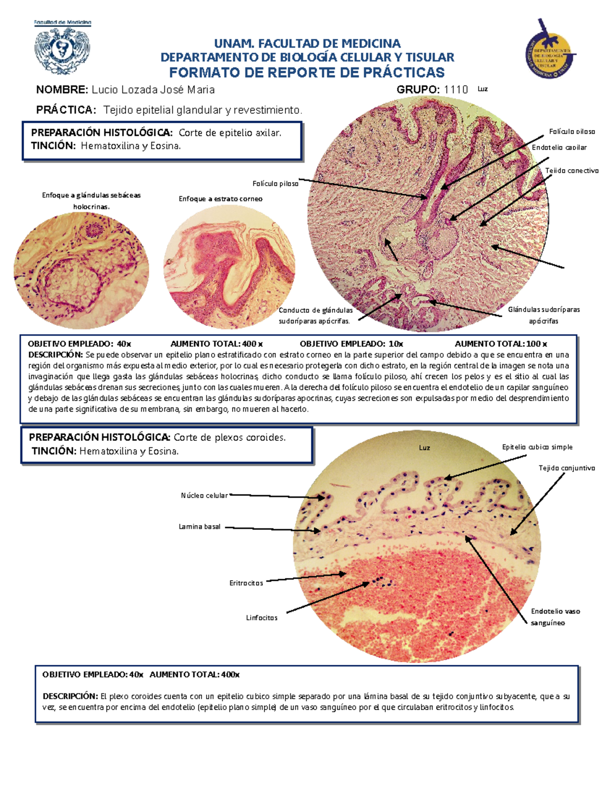 Cortes histológicos de axila y coroides - UNAM. FACULTAD DE MEDICINA ...