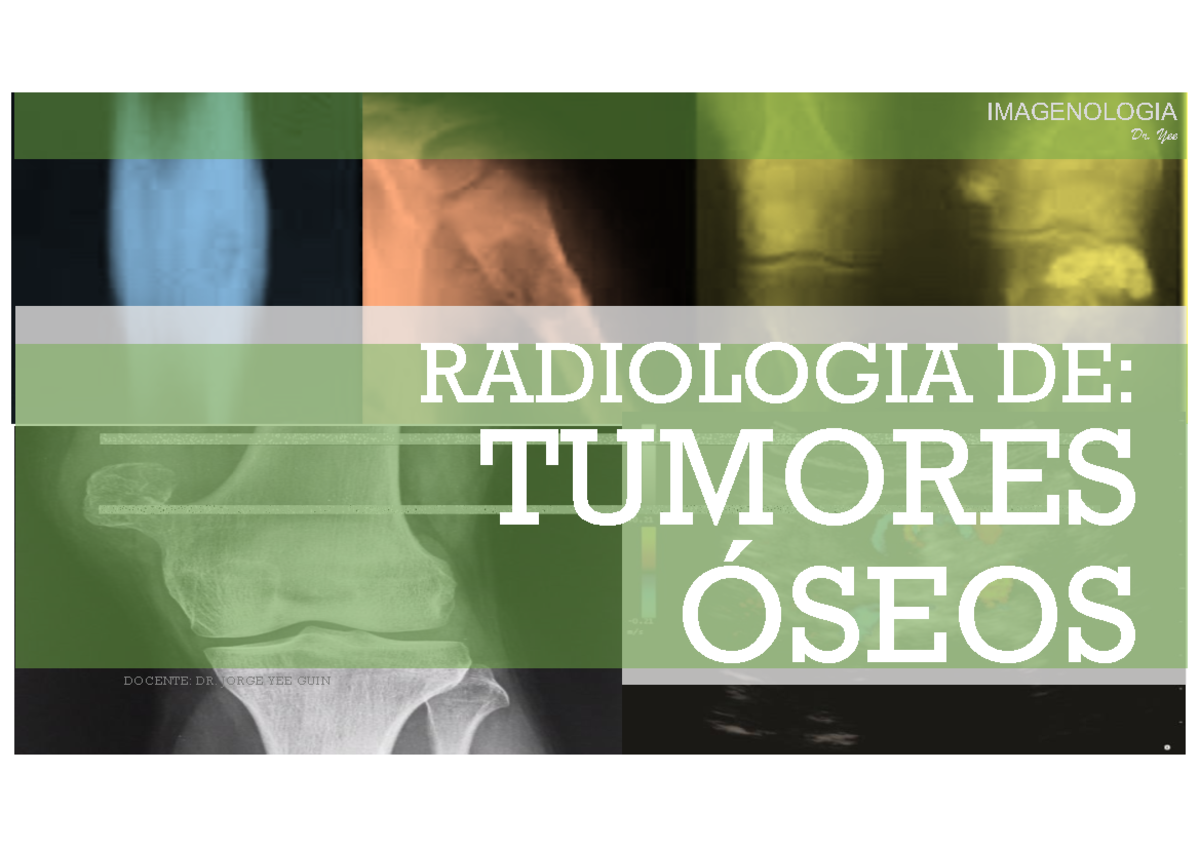 2. Tumores oseos en modf - IMAGENOLOGIA Dr. Yee RADIOLOGIA DE: TUMORES ÓSEOS DOCENTE: DR. JORGE ...