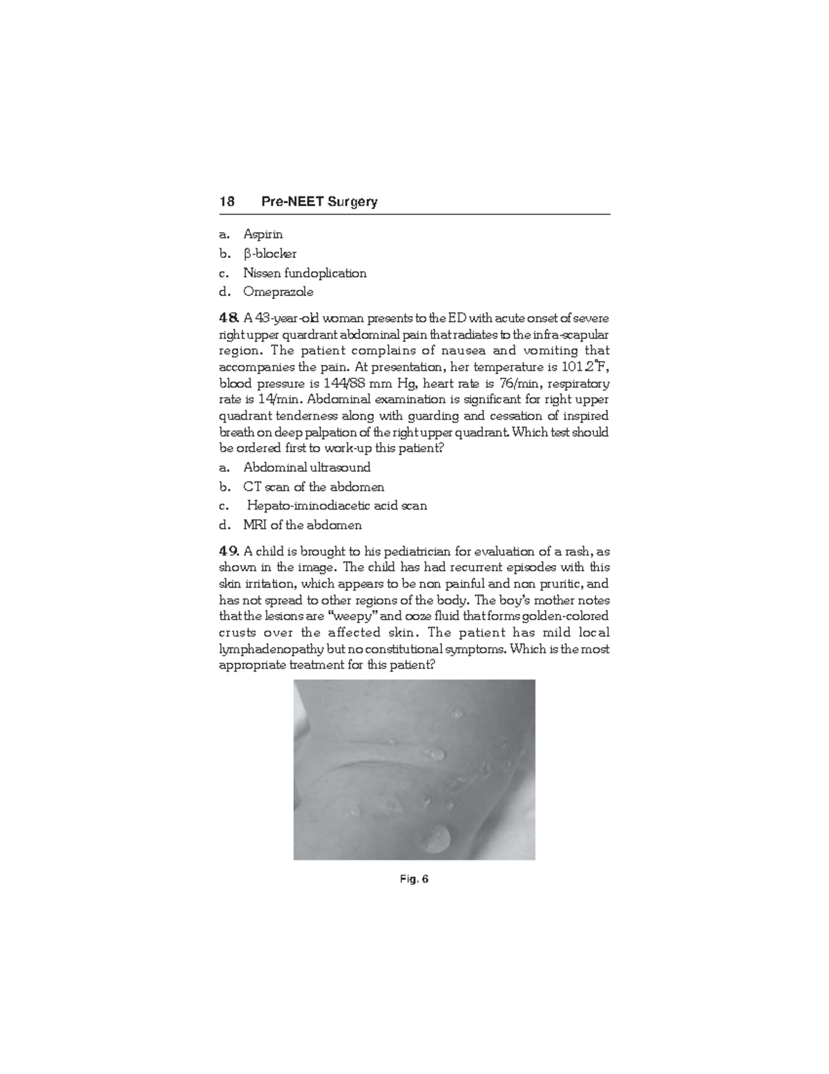 Pre-NEET Surgery-18 - NEET Surgery - 18 Pre-NEET Surgery a. Aspirin b ...