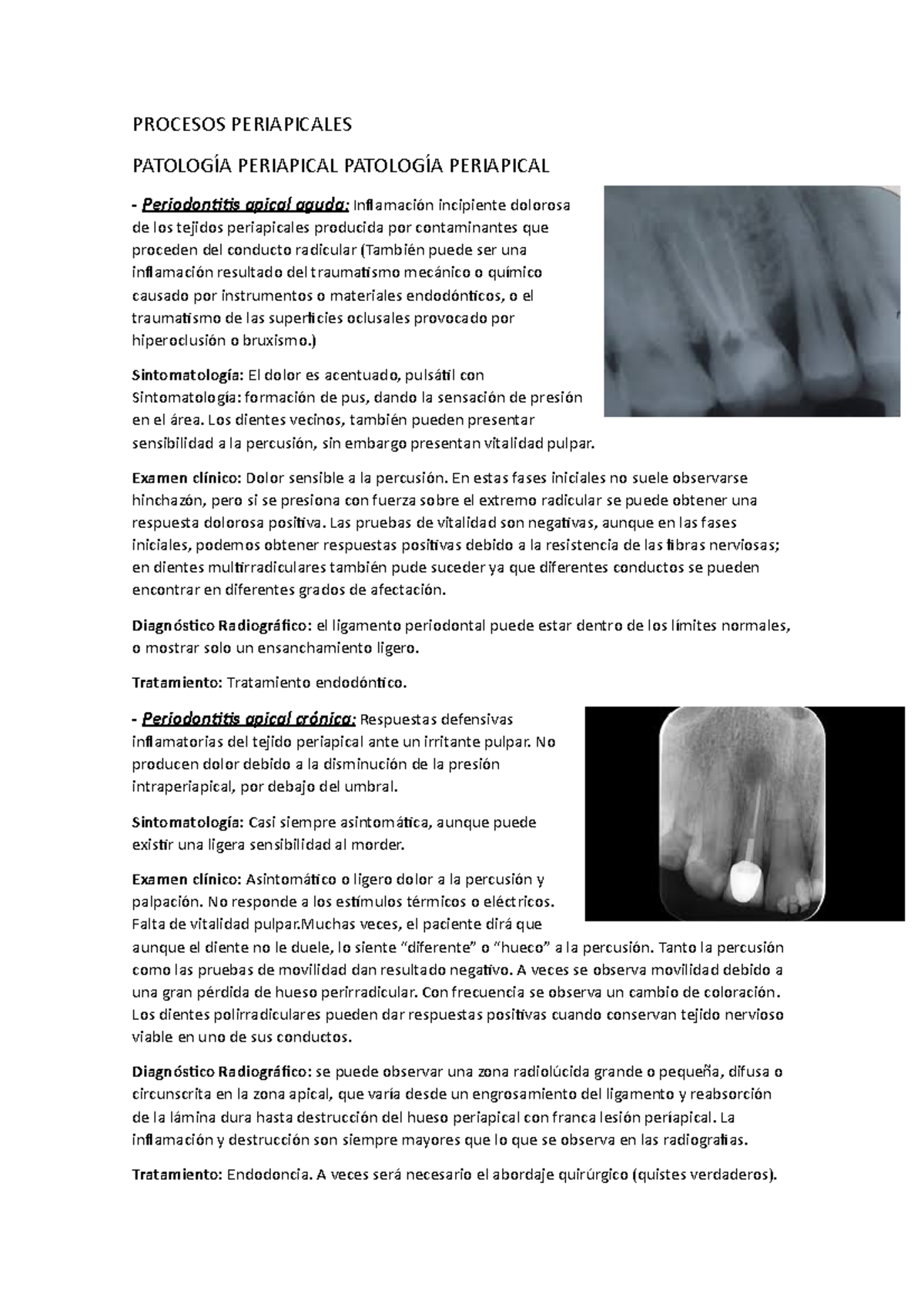 Procesos Periapicales - PROCESOS PERIAPICALES PATOLOGÍA PERIAPICAL ...