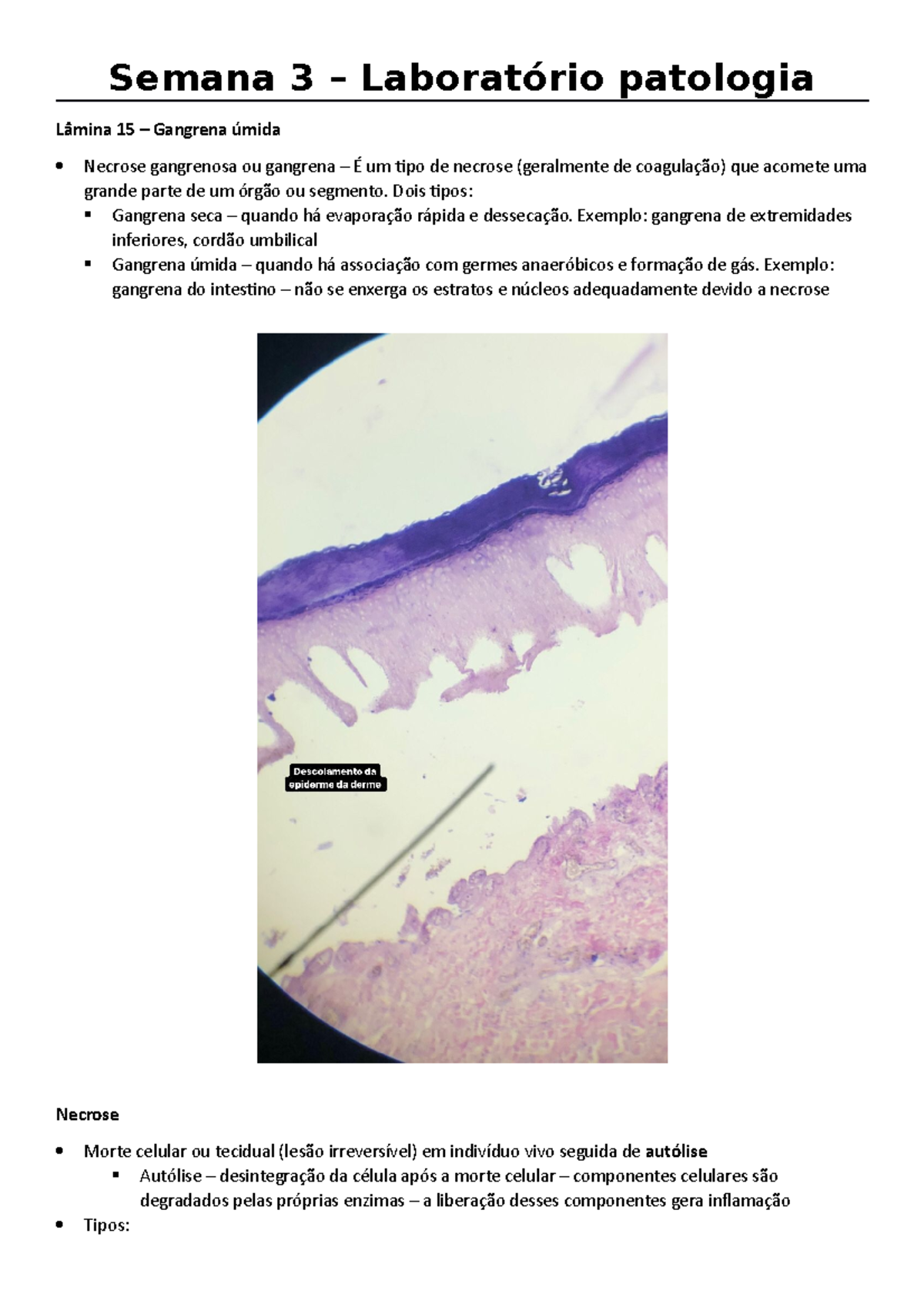 Semana 3 - gangrena - Laboratório prático - microscopia + anotações ...