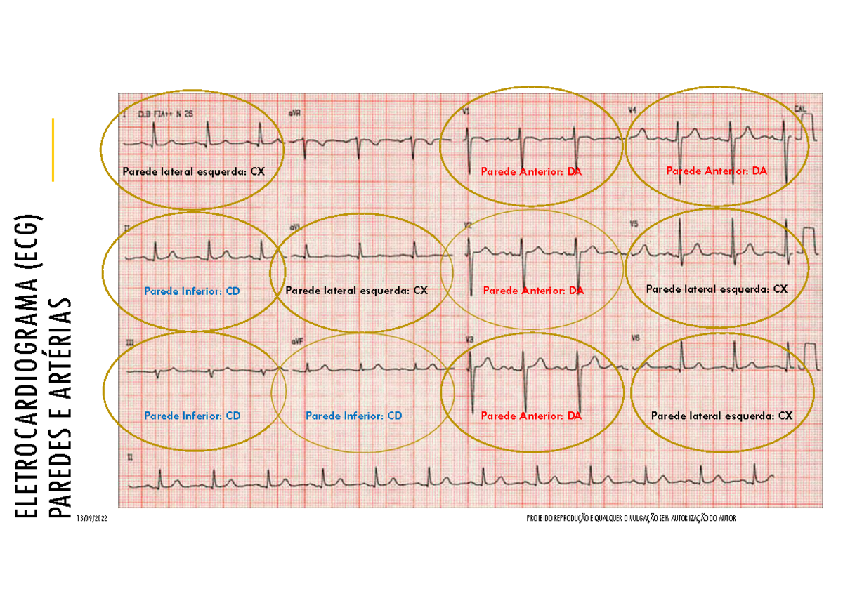 Esquema de estudo sobre cardio e exercícios de fixação ...
