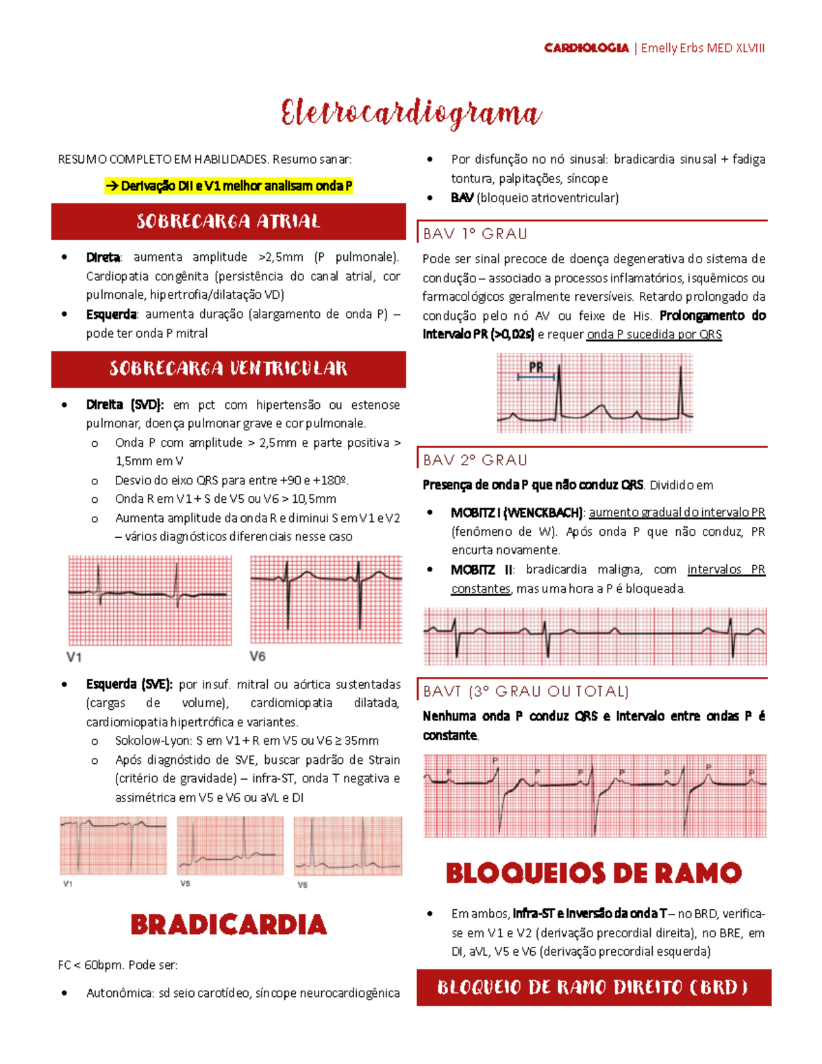 Cardiologia parte 3 - ECG - Eletrocardiograma RESUMO COMPLETO EM ...