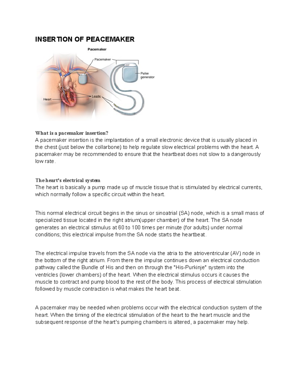 Insertion OF Peacemaker - INSERTION OF PEACEMAKER ####### What is a ...