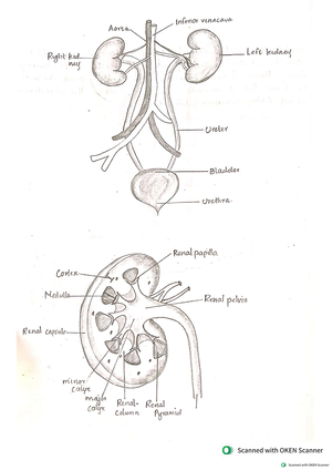 Intervertebral disc prolapse - Auxiliary midwifery nursing - Studocu