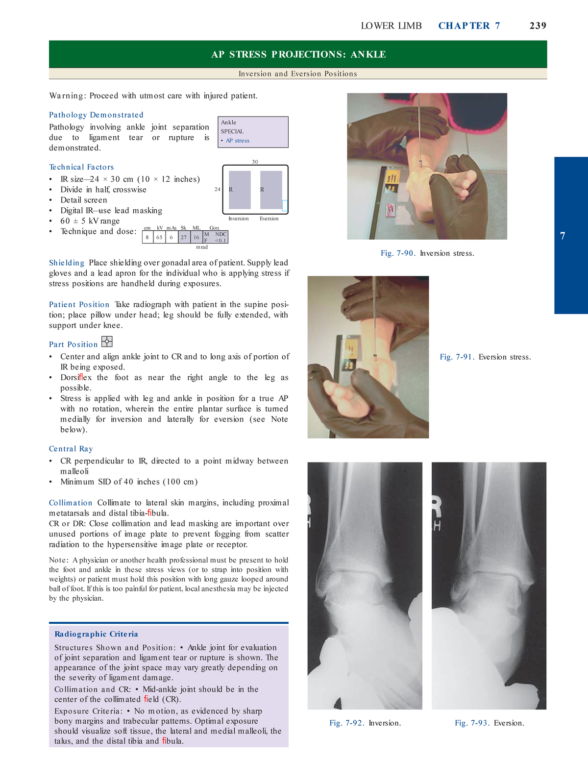 AP STRESS PROJECTIONS: ANKLE - LO W E R LI M B CHAP TER 7 239 7 AP ...