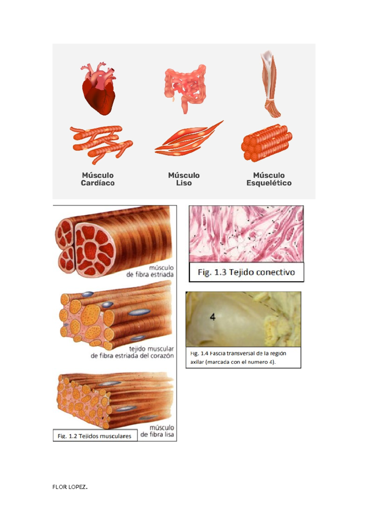 Tipos DE Musculos - ES DOCUMENTO ESPECIFICOS DE LAS COSAS - Biology SL ...