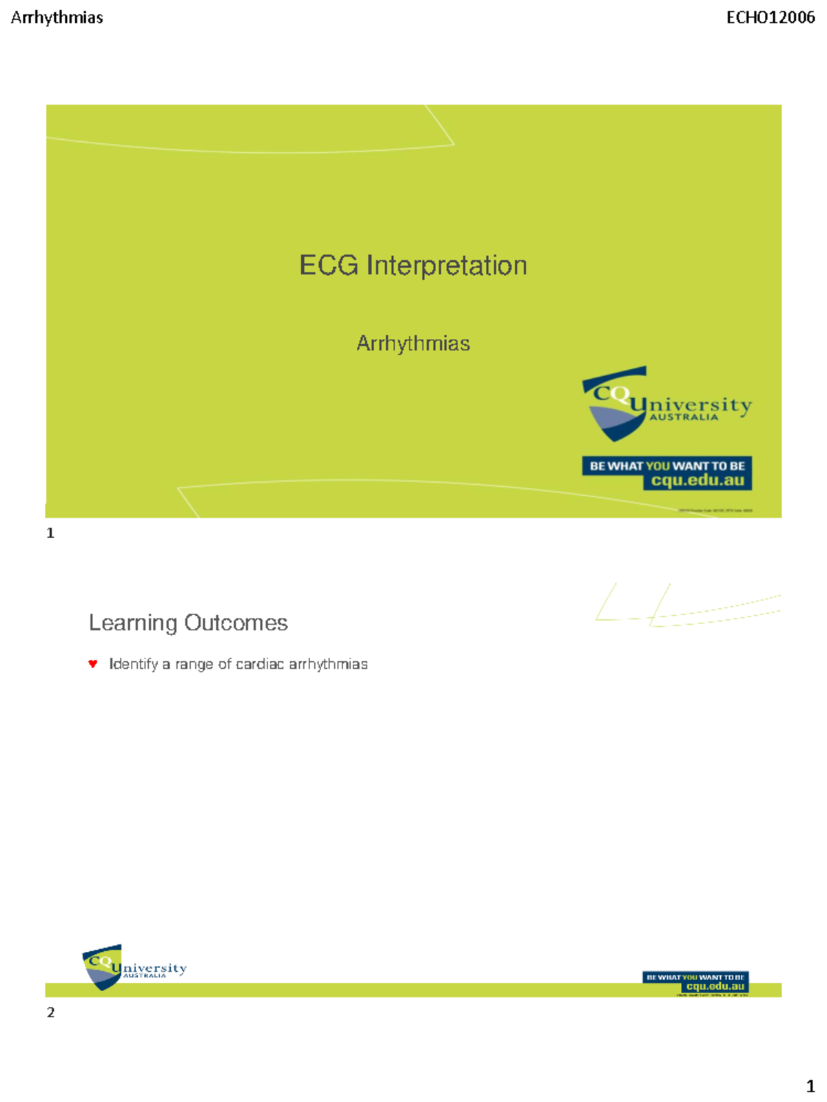 ECG Interpretation Arrythmias Lecture Slides - ECG Interpretation ...