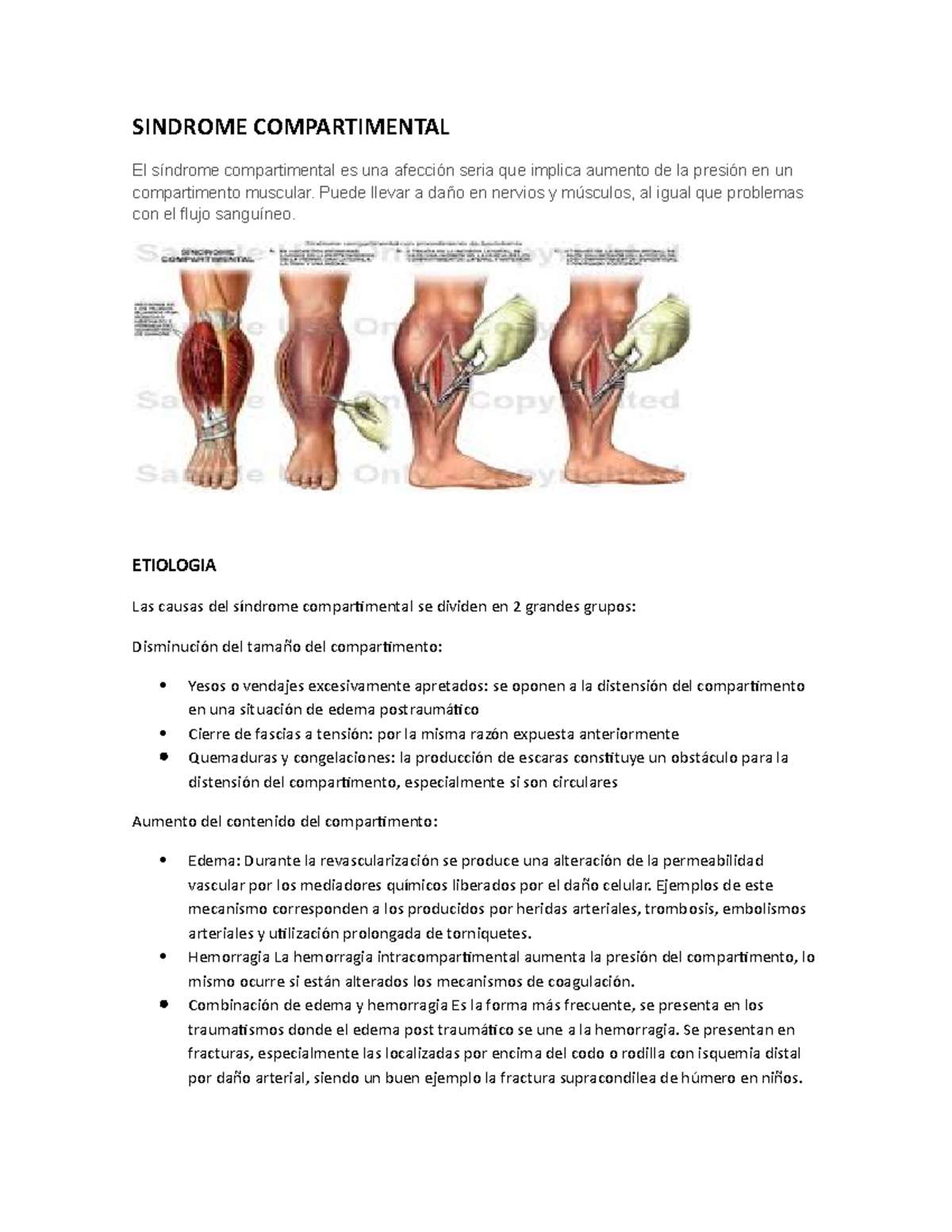 Enfermedades Metabolicas DE LOS Musculos - SINDROME COMPARTIMENTAL El ...