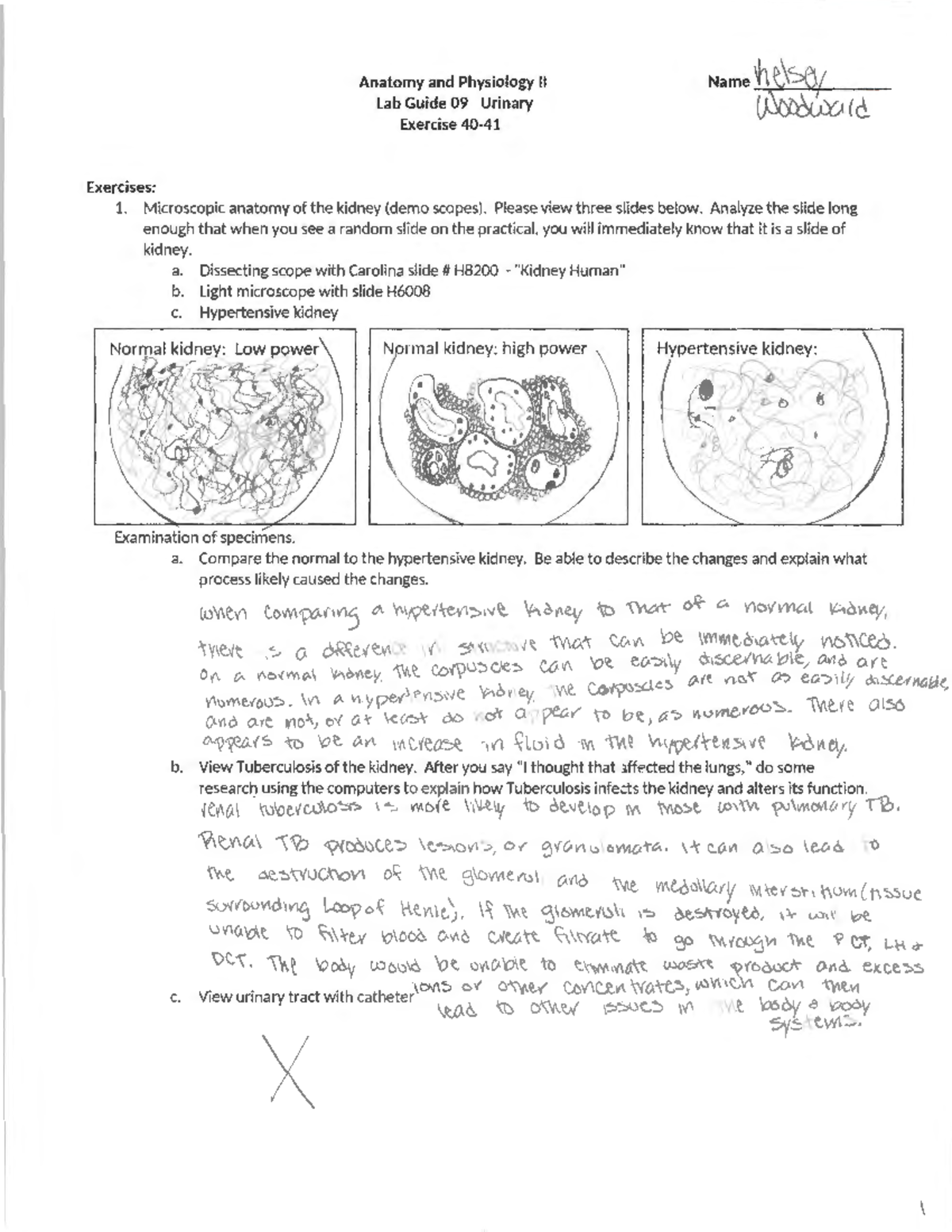 Urinary Lab Document - Exercises: Anatomy and Physiology II Lab Guide ...