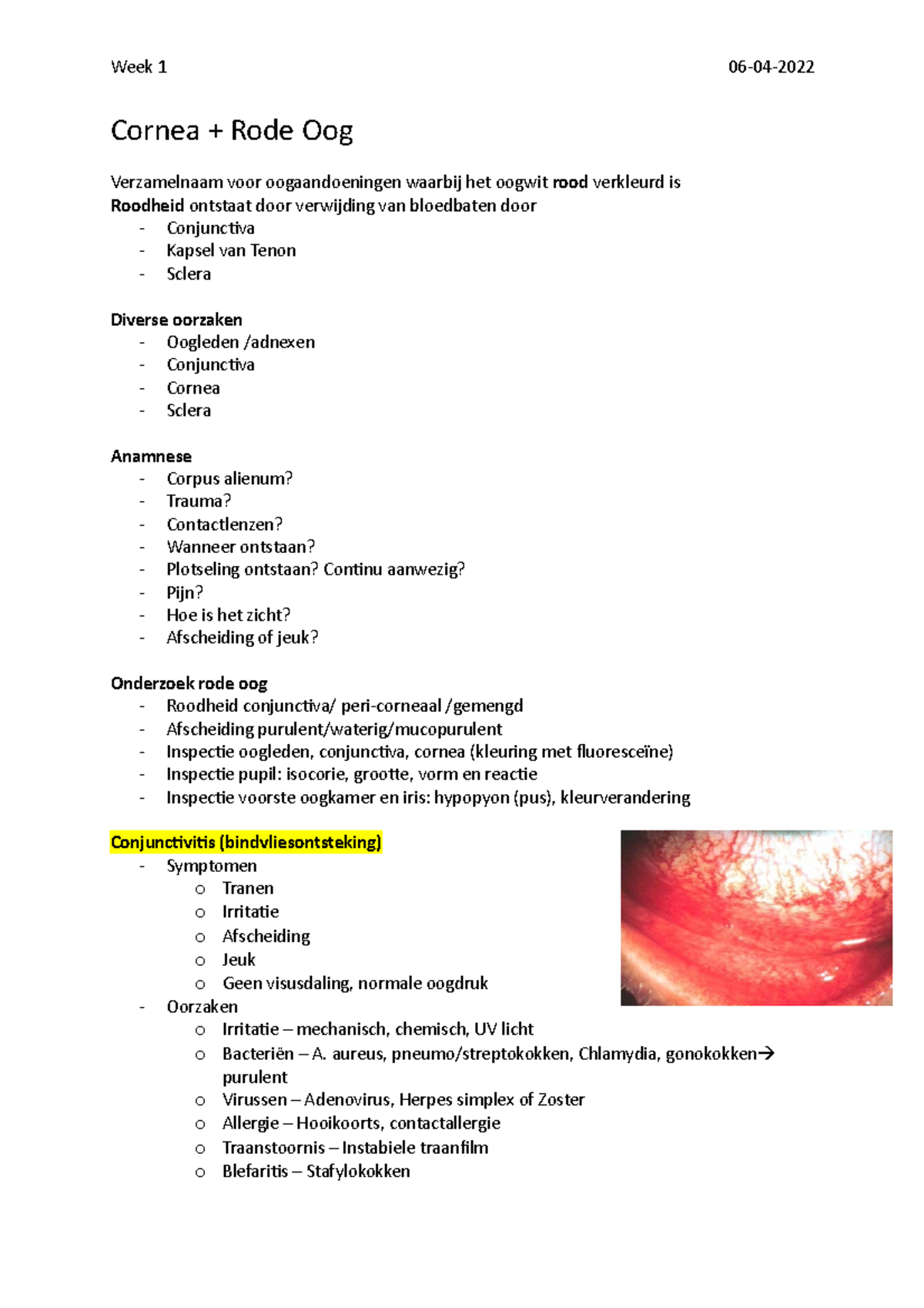 Cornea + Rode Oog - Cornea + Rode Oog Verzamelnaam voor oogaandoeningen ...