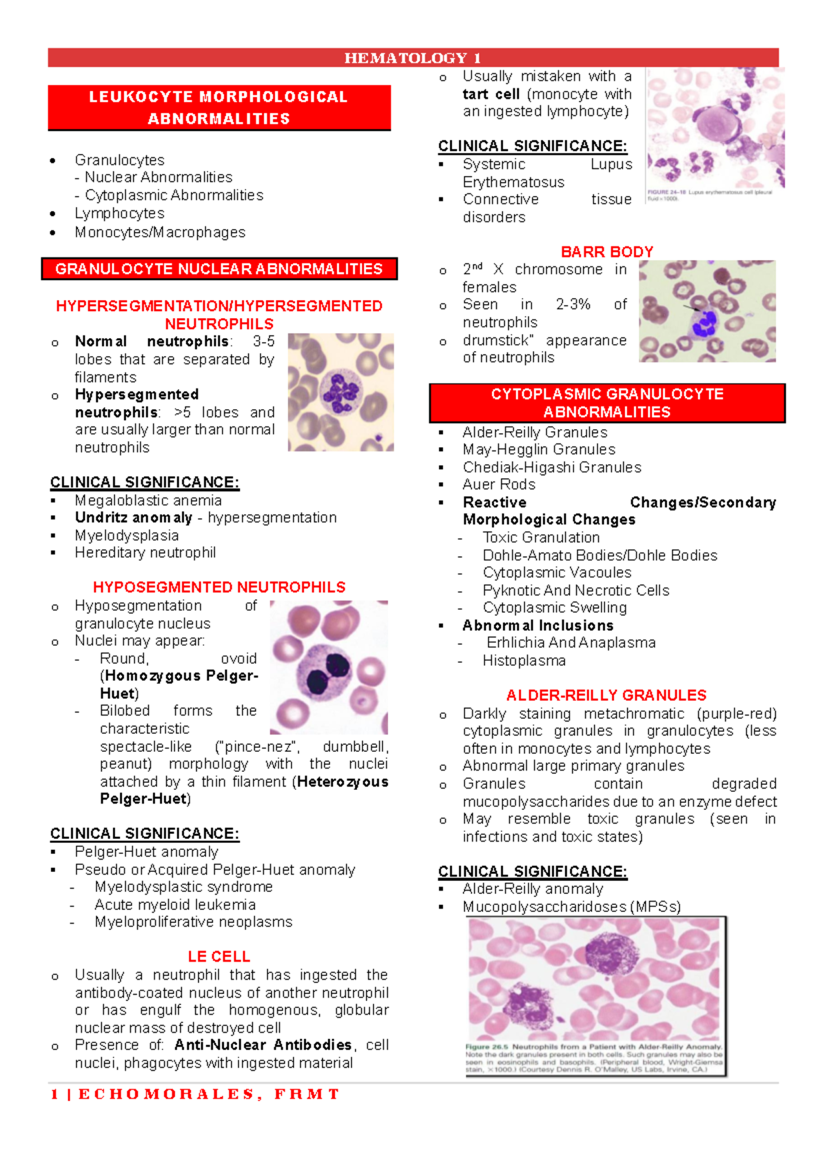 WBC Abnormalities - HEMA - LEUKOCYTE MORPHOLOGICAL ABNORMALITIES ...